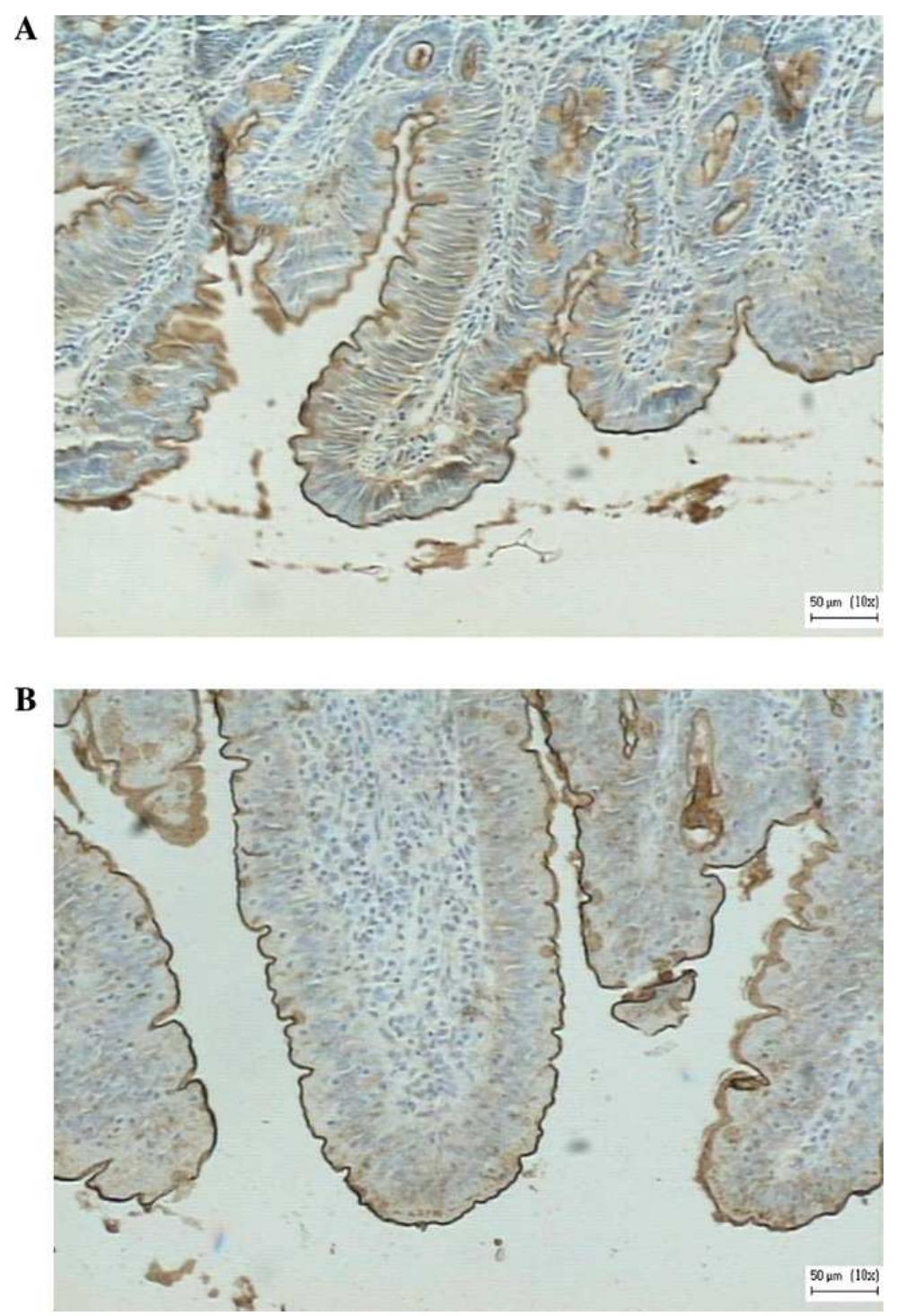 Ulex immunolabelling in the duodenum of pig infected with