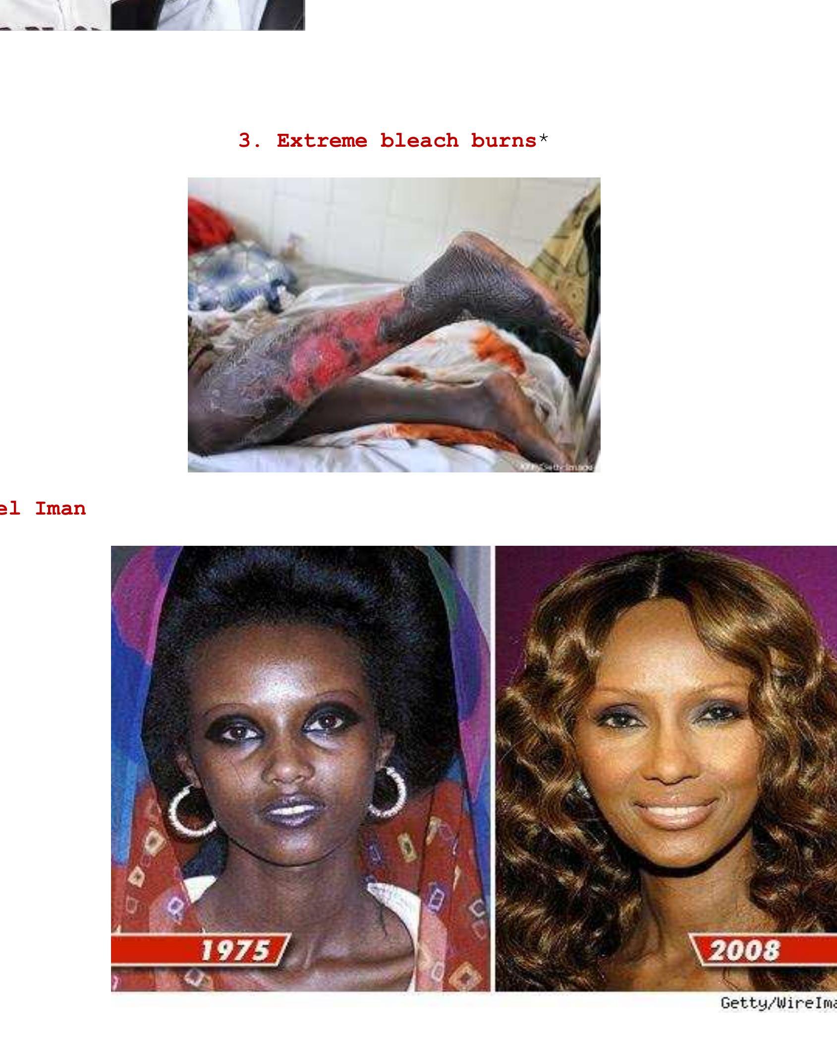 Figure 6 - The Causes & Effects of the use of Skin Bleaching