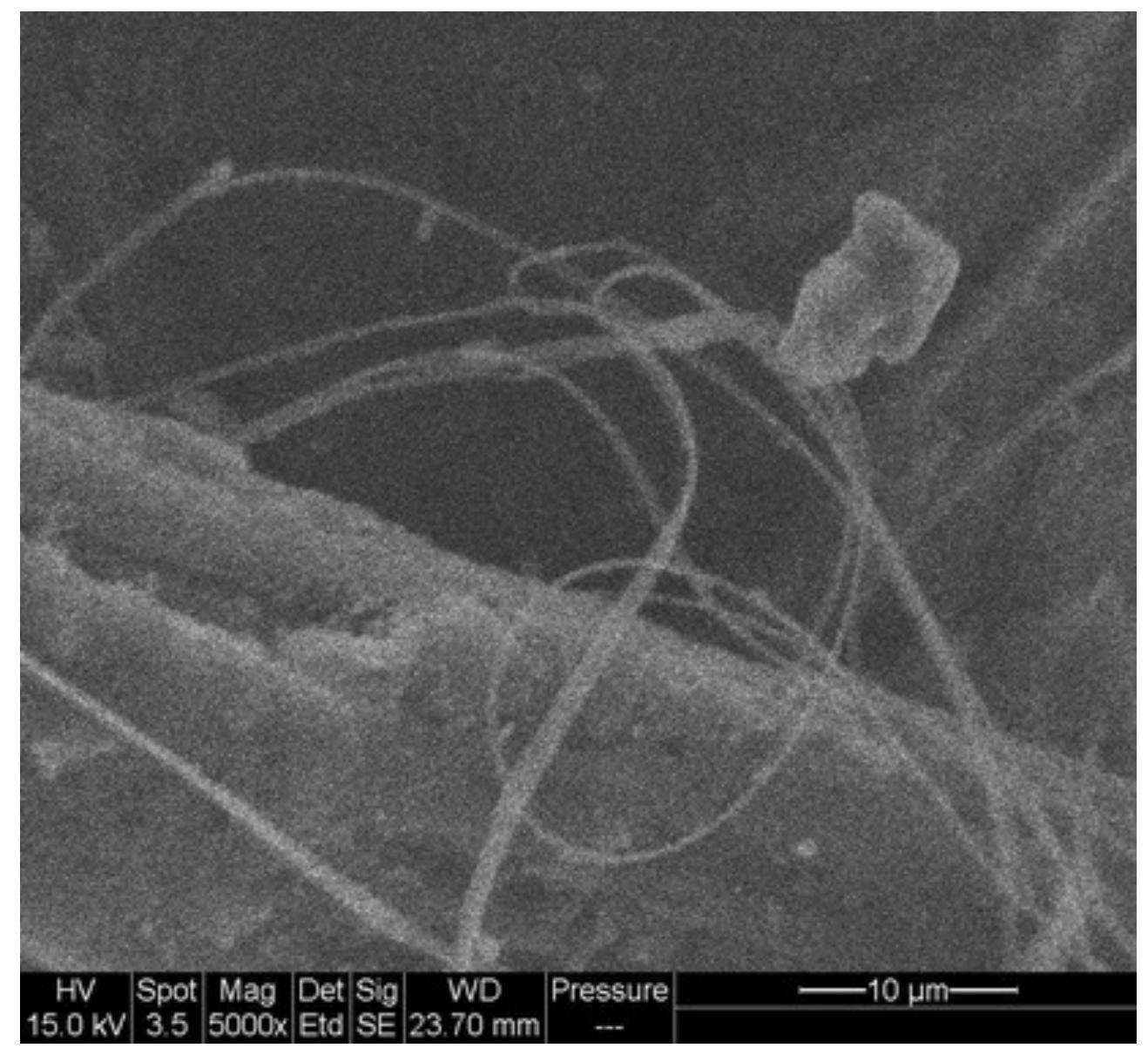 37 sem photo shows the fungal growth on the textile.