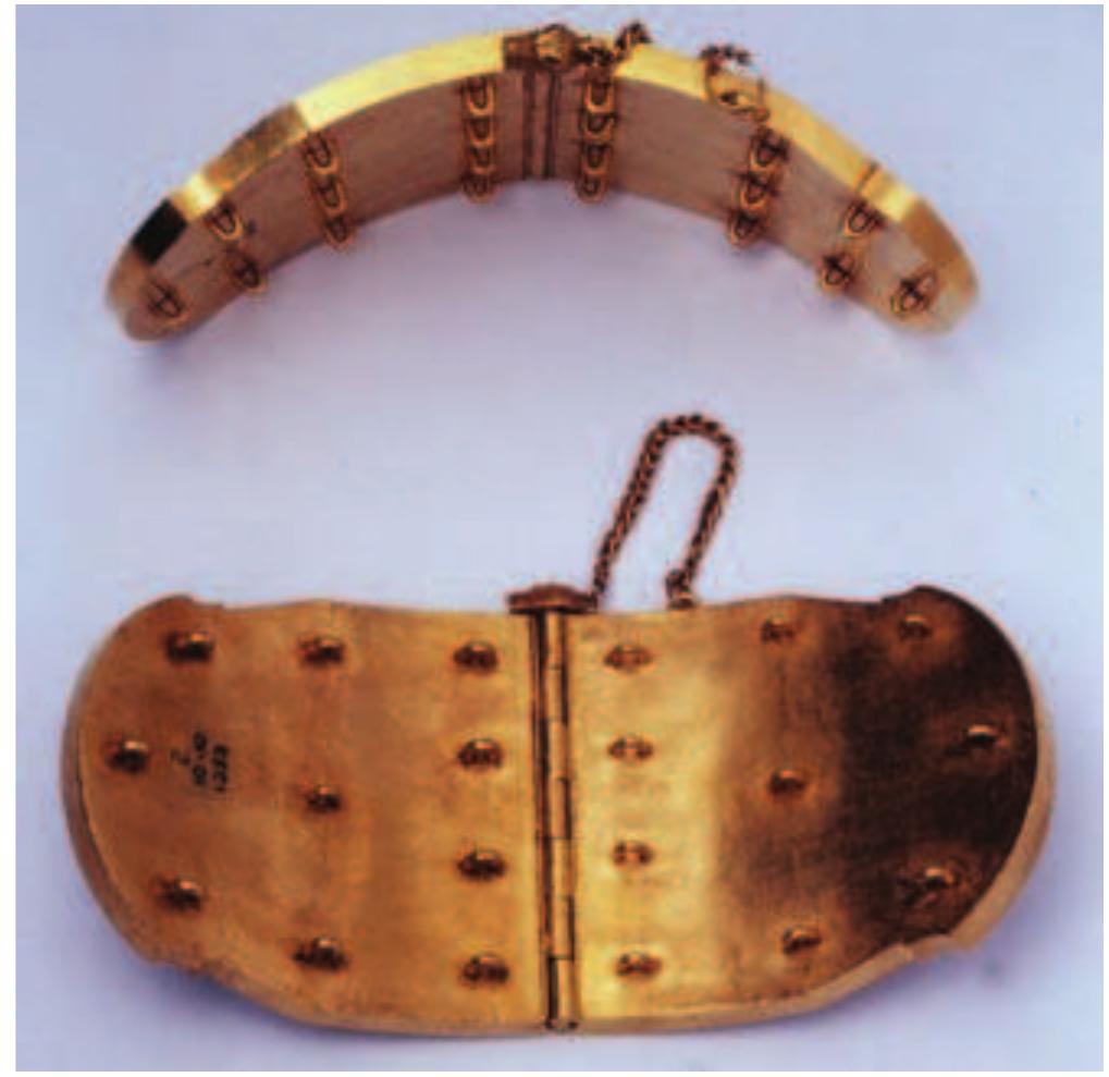 Figure 17 - Rethinking the Sutton Hoo Shoulder Clasps and