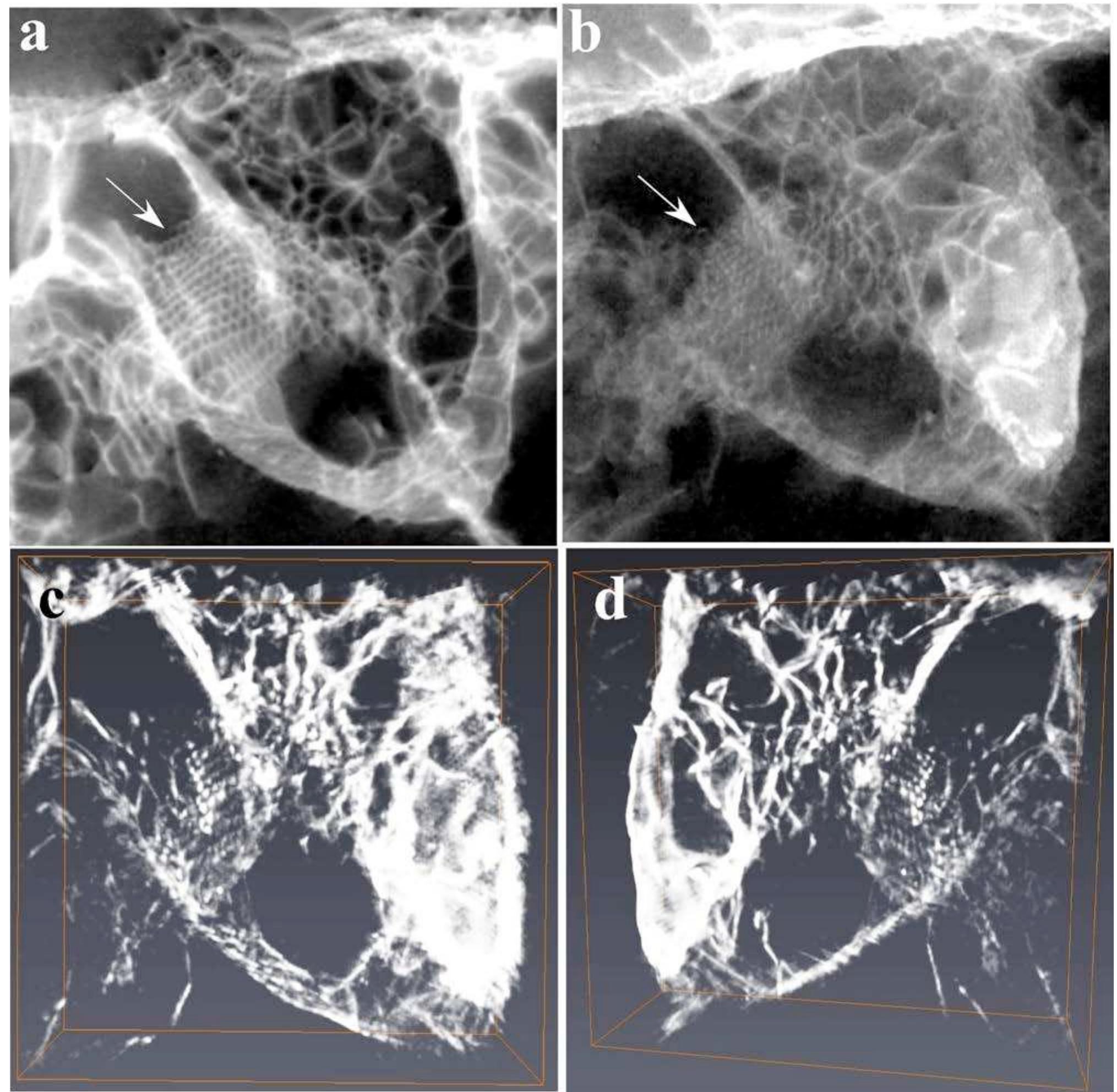 Figure 5 - Dislocation electron tomography of boundaries in