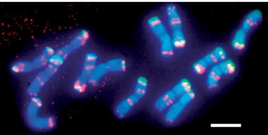 Metaphase chromosomes from rye photographed under the light