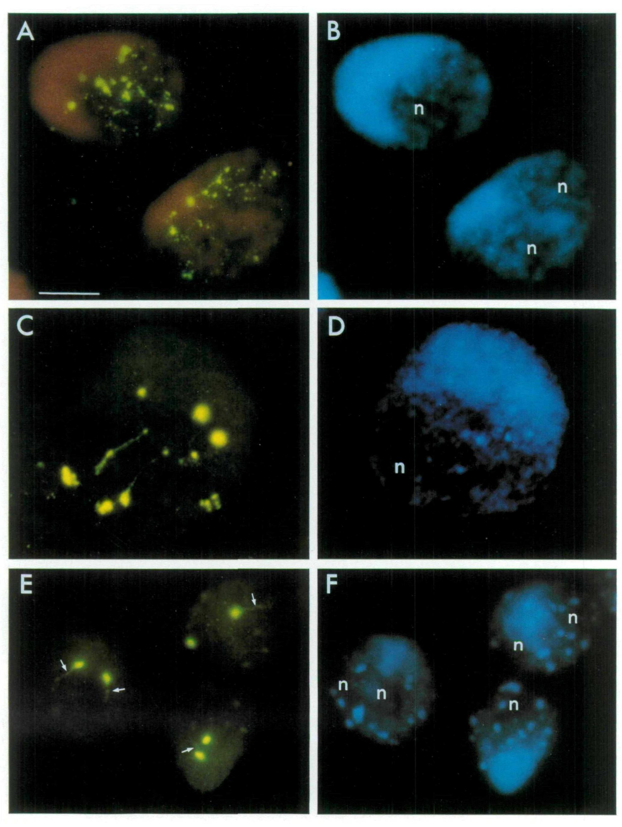 Interphase nuclei after in situ hybridization with labelled