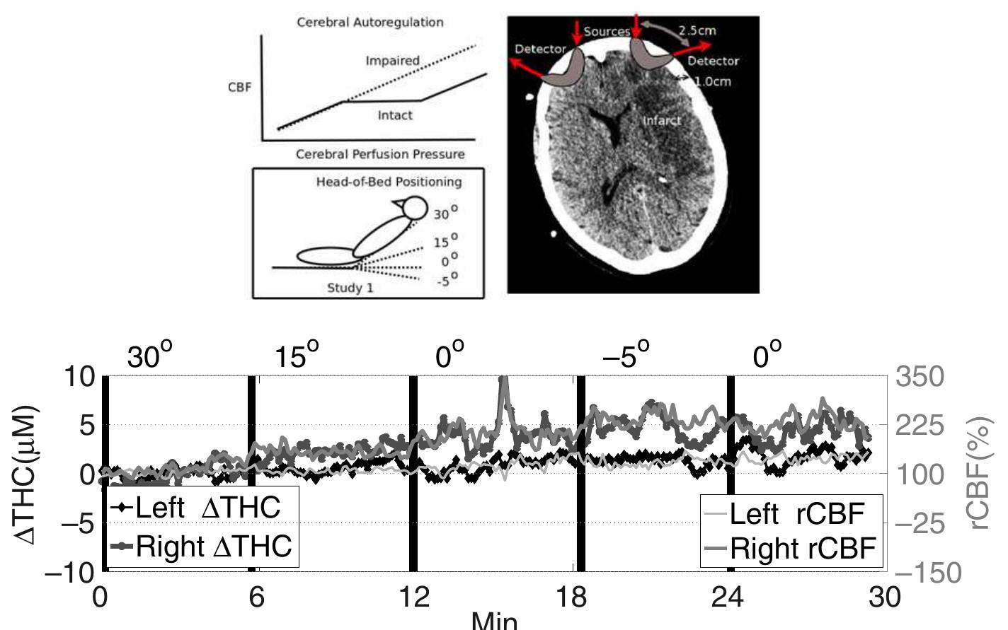 (top) cerebral autoregulation implies a range of cerebral