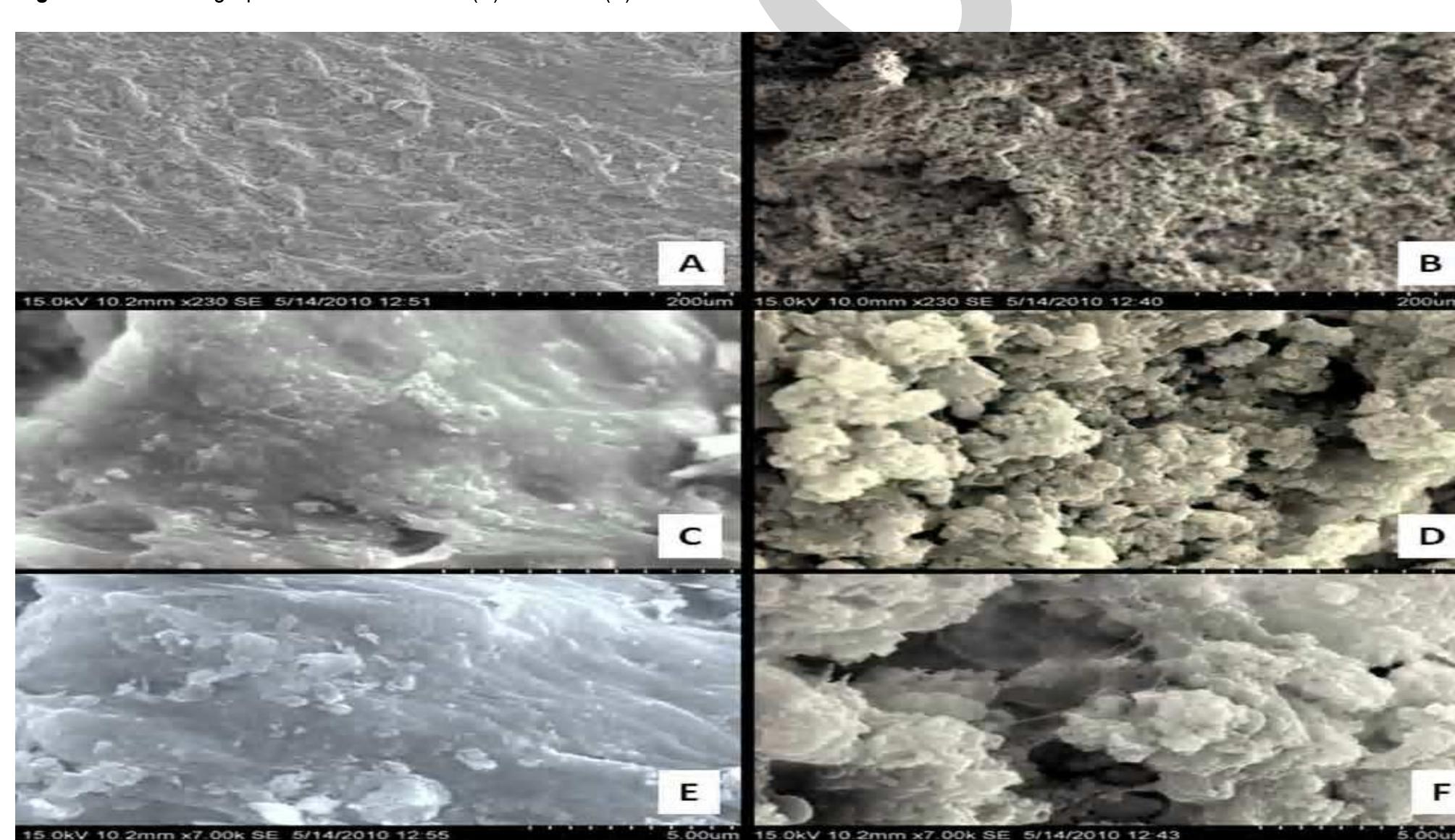 Scanning electron microscopic photographs of coconut coir