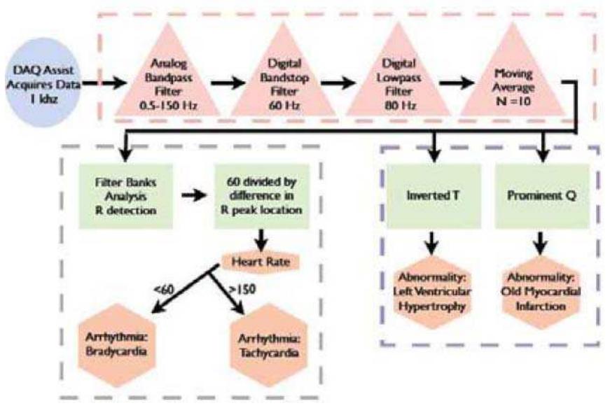 Figure 14 - Study and Analysis of ECG Signal Using MATLAB