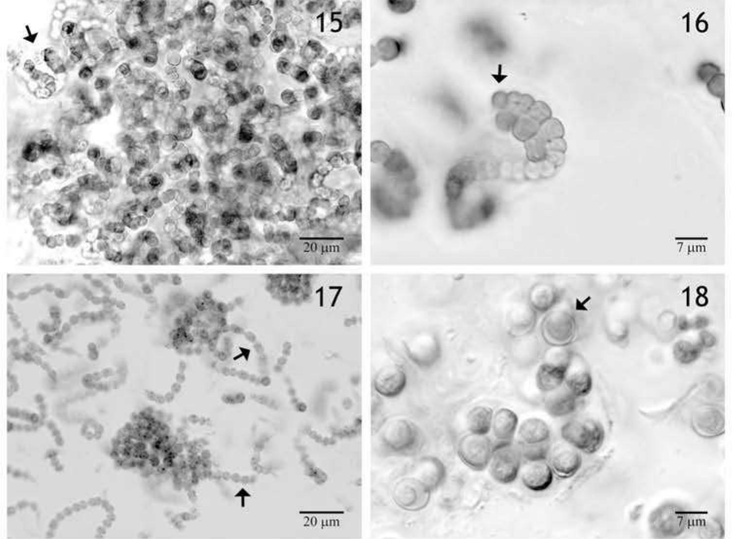 S 15-18. nostoc sphaericum life cycle phases in bg-11,,