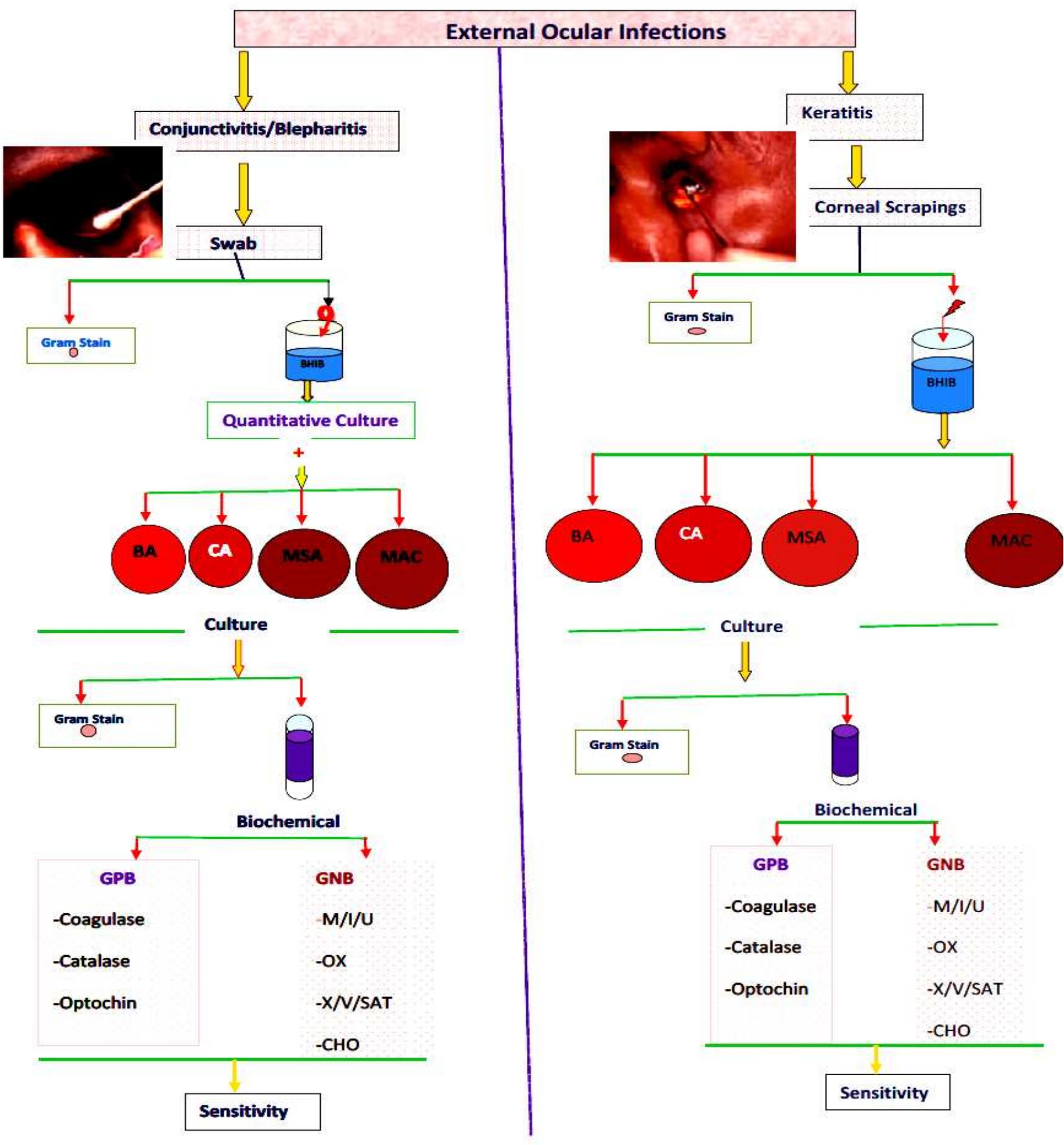 Gpb=gram positive bacilli, gnb= gram negative bacilli,