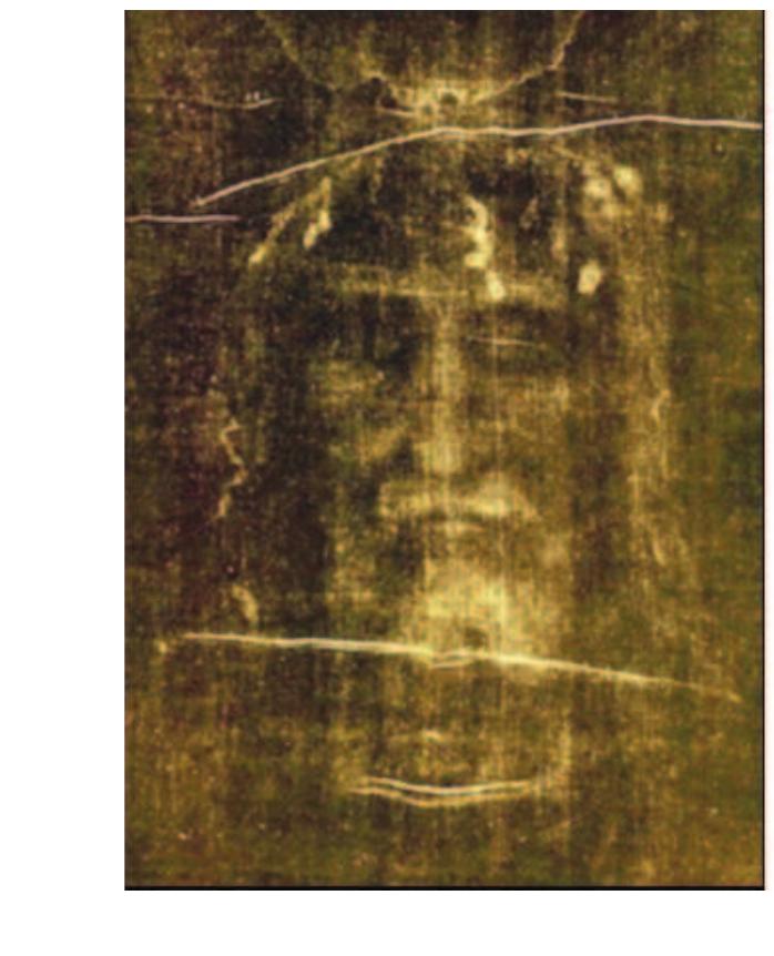 Processed image using filter erosion of pixels with anim tc