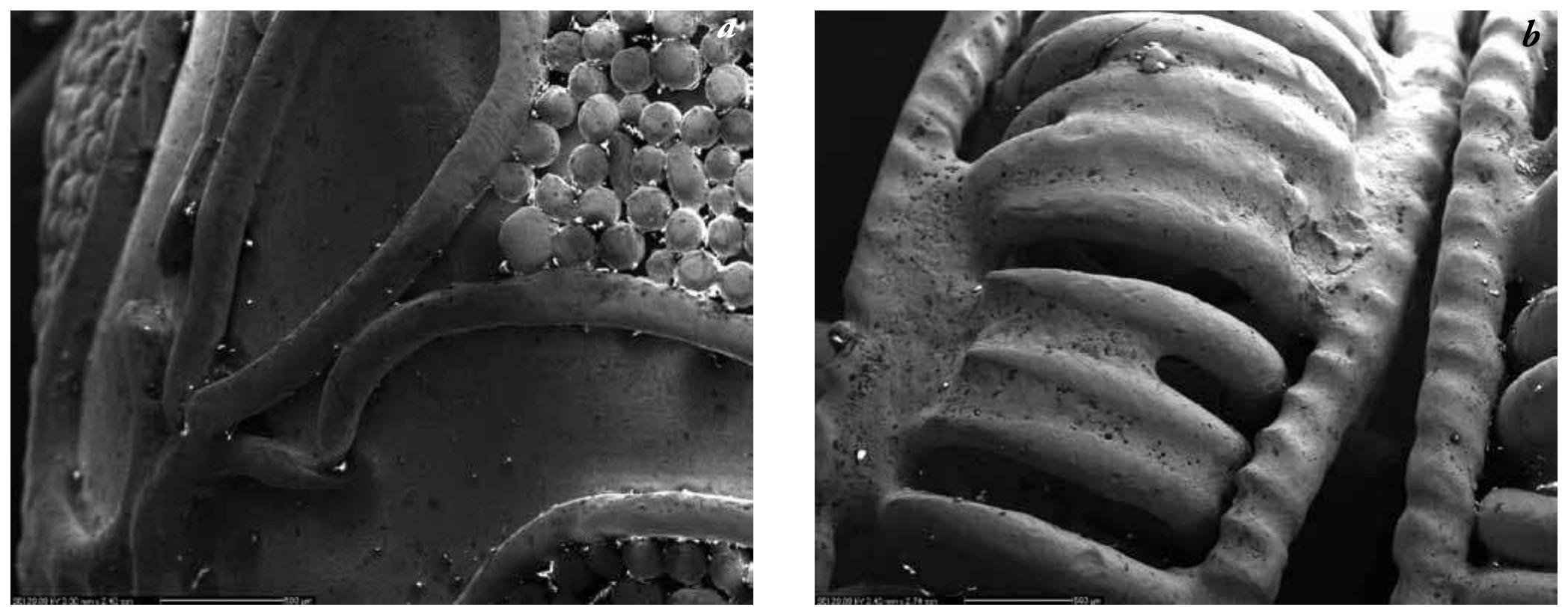 Sem-sei micrographs of earring a.1905.914.2 from the nms,