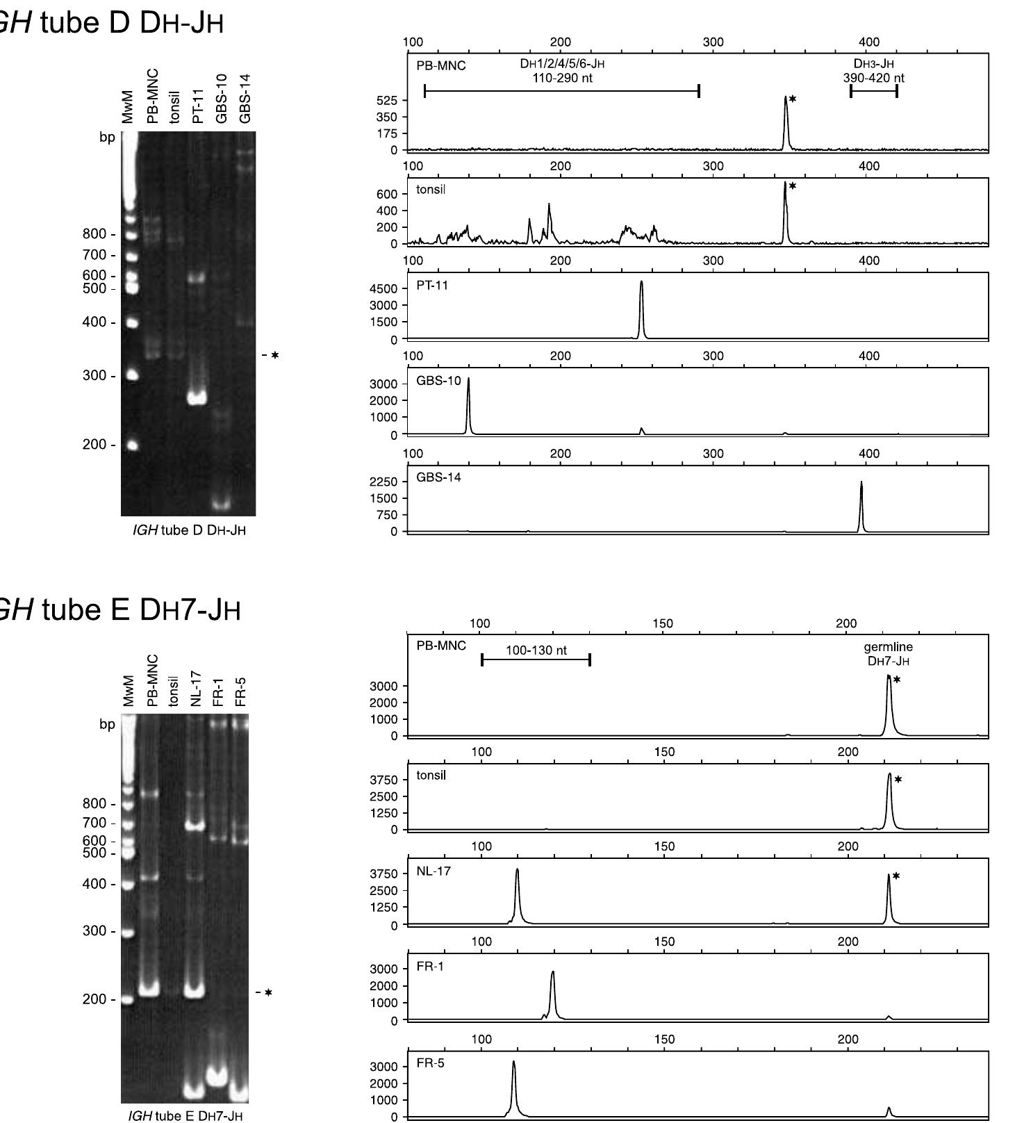 Pcr analysis of [gh (dh-jh) rearrangements. (a) schematic