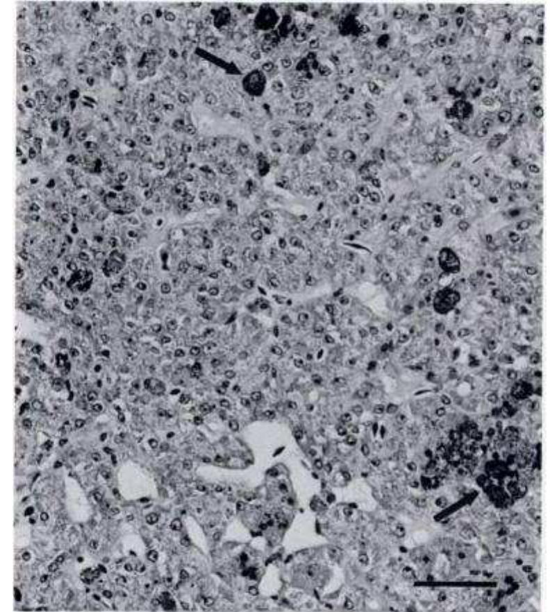 Photomicrograph of atrophic liver (tortoise 23). variably