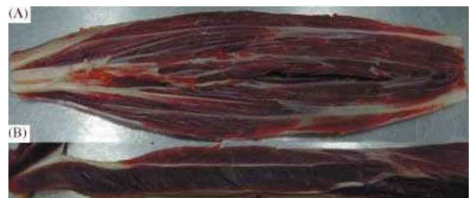 Internal architecture of flexor digitorum superficialis