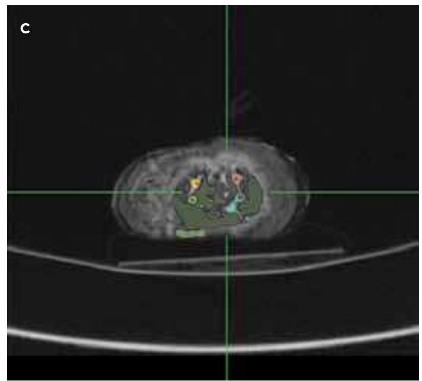 6. (a) sagittal, (b) coronal, and (c) axial sections through