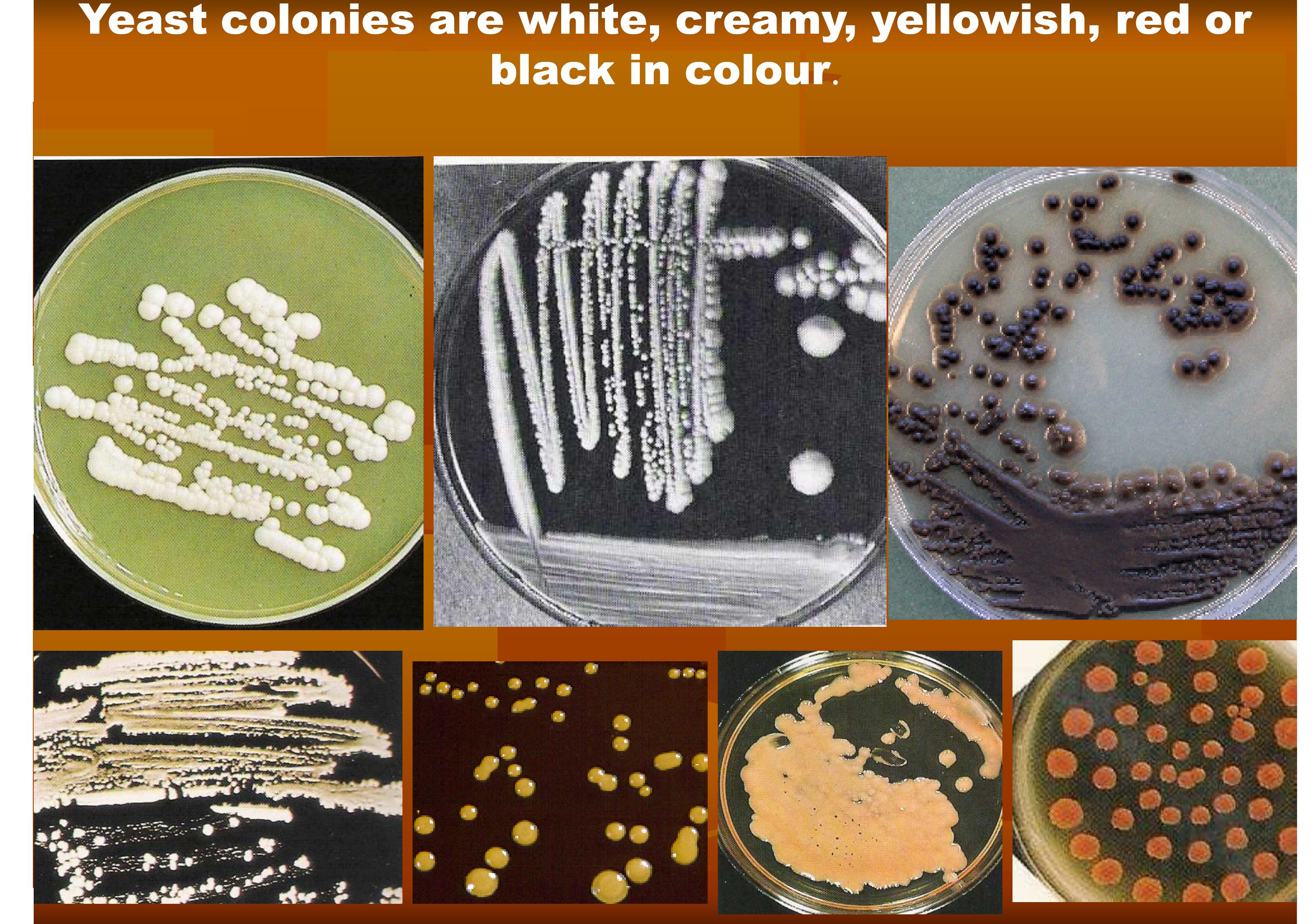 Figure 2 - Yeasts of medical importance ppt lecture by Prof.
