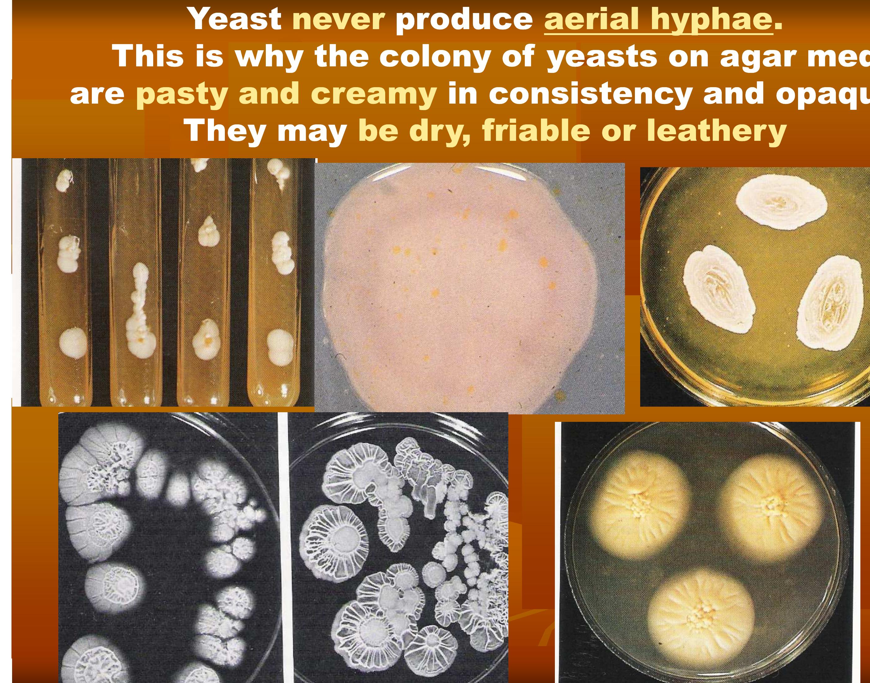 Figure 4 - Yeasts of medical importance ppt lecture by Prof.