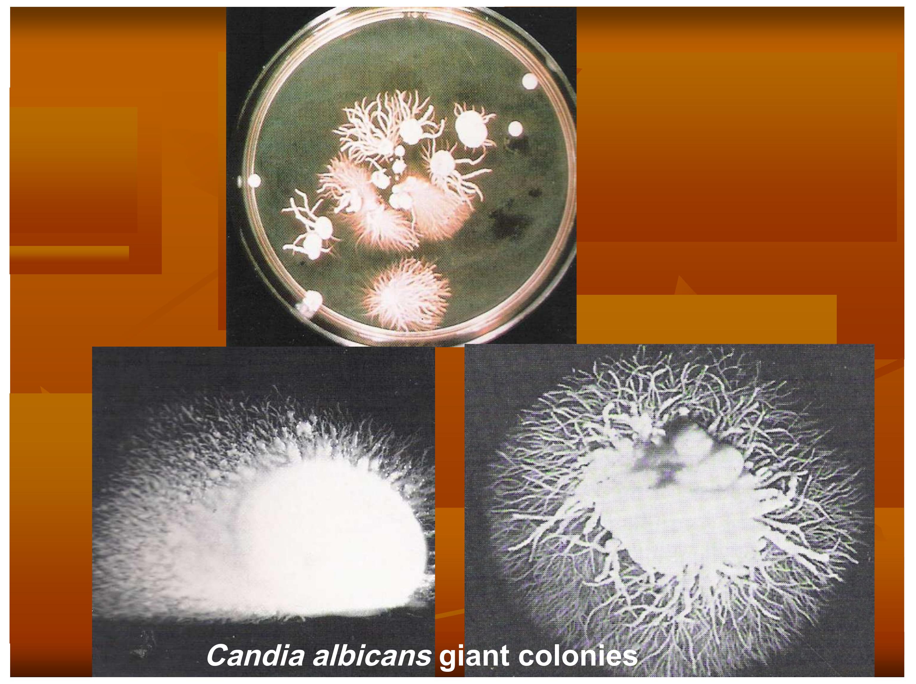 Figure 15 - Yeasts of medical importance ppt lecture by