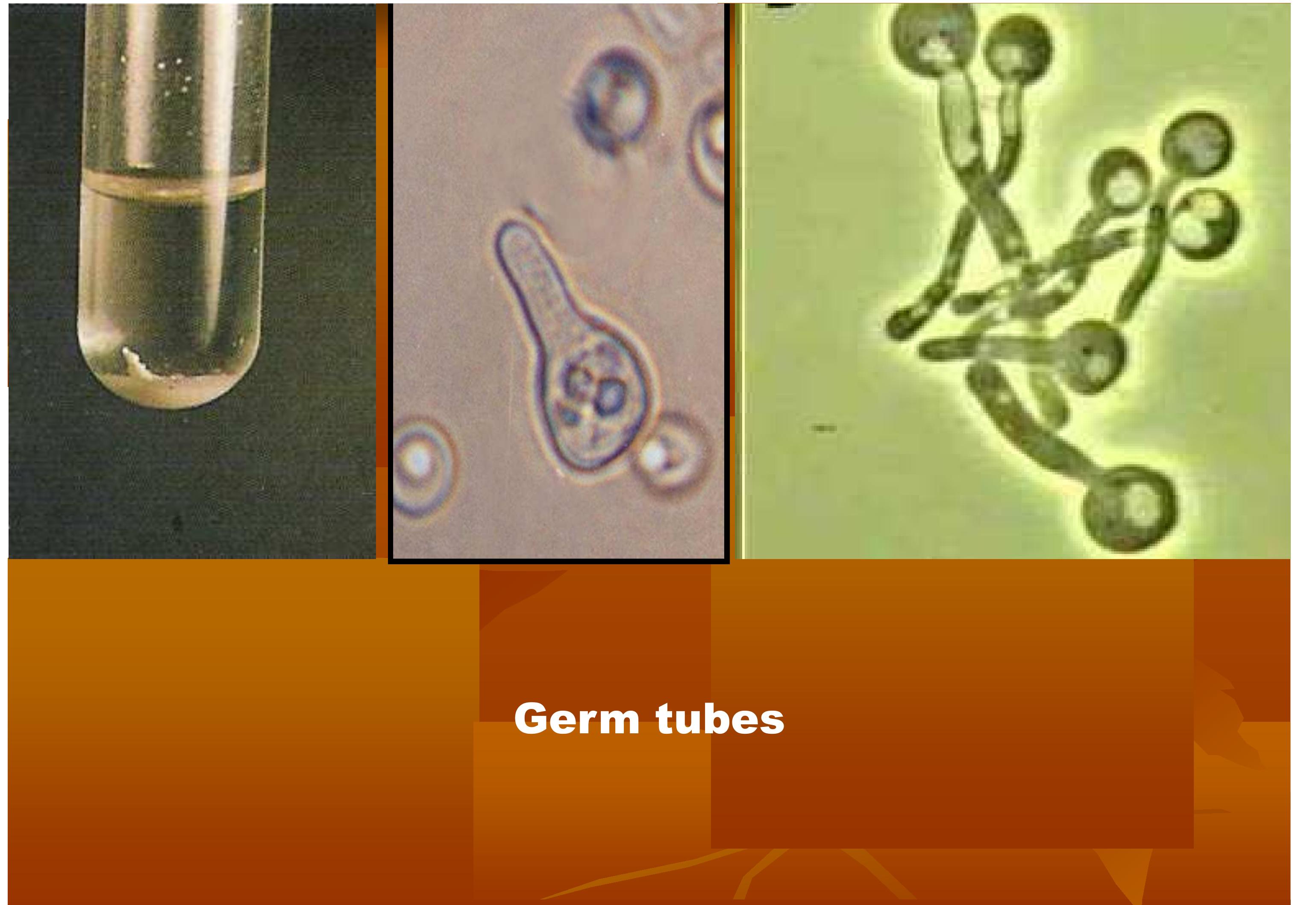 Figure 17 - Yeasts of medical importance ppt lecture by