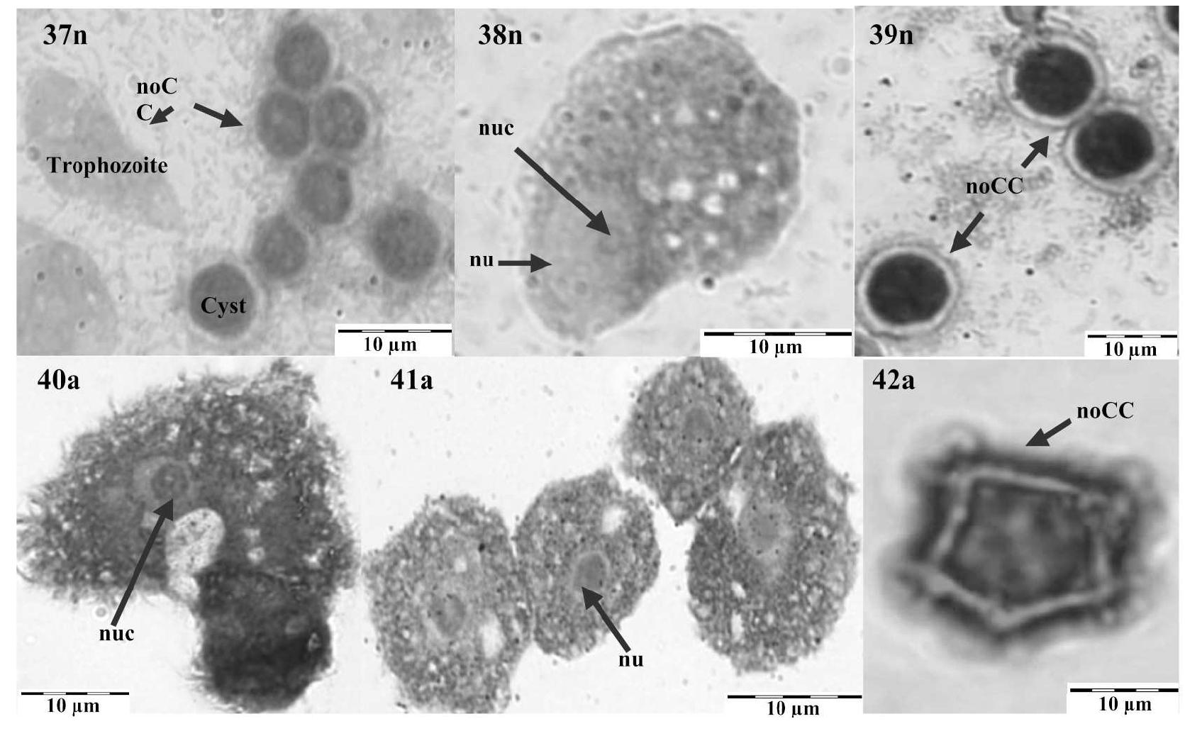 5. original and 6. modified acid-fast bacilli (afb) stain