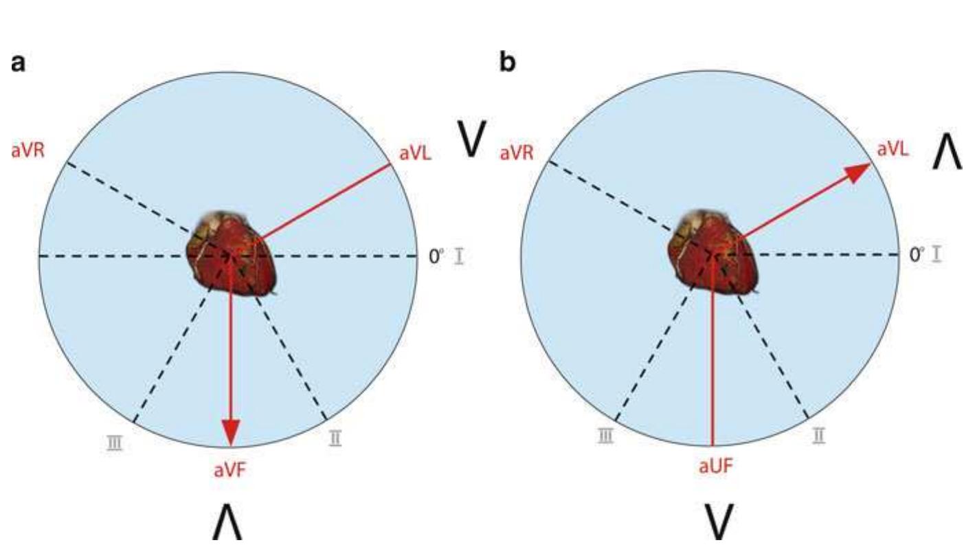 3. the orientation of the heart in chest cavity. panel (a)