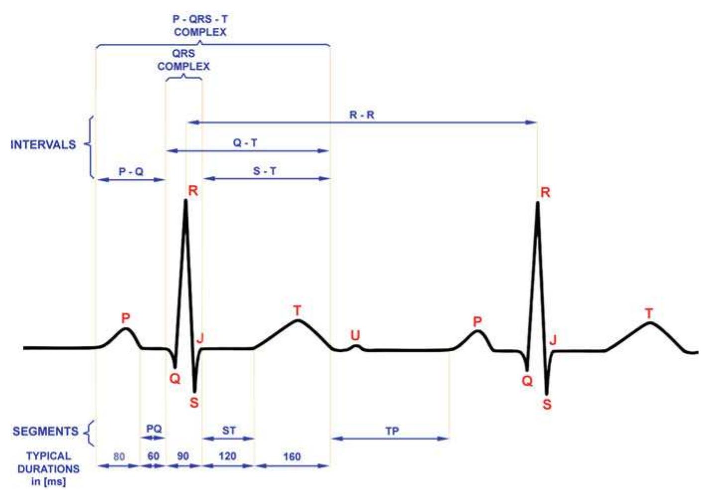 2. typical shape of ecg signal and its essential waves and