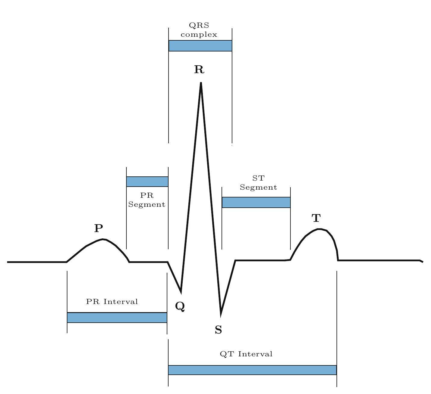 2 schematic representation of a normal ecg: qrs complex; pr