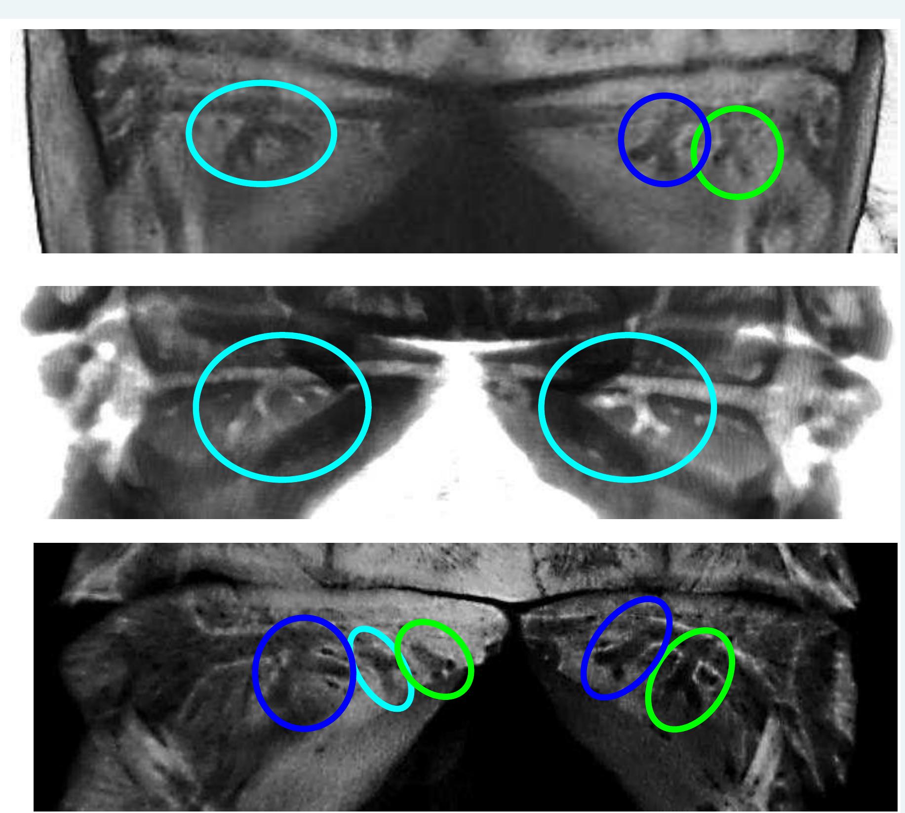 Figure 21 - How to build a fish head? Modularity of lateral