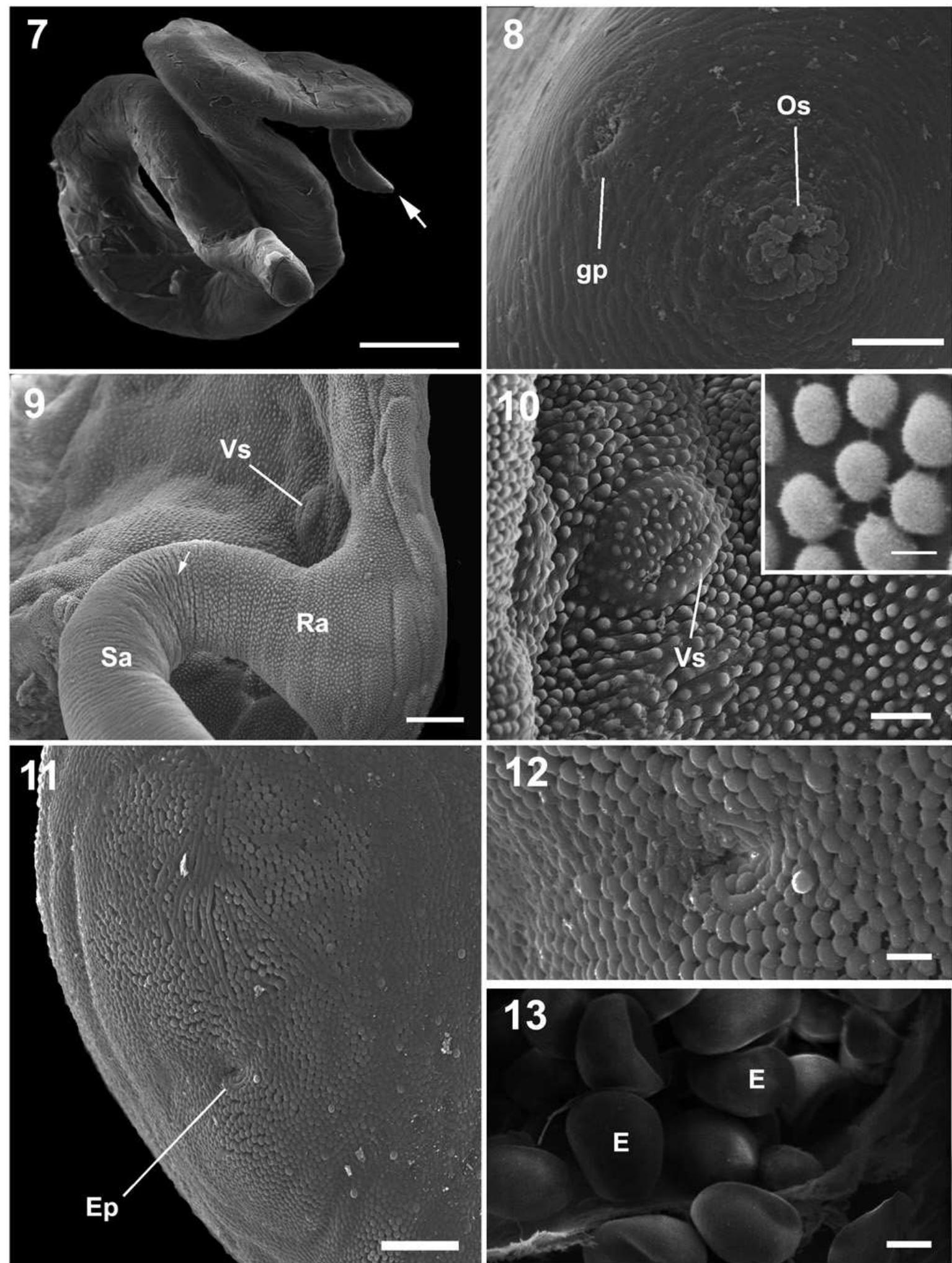 S. 7-13. scanning electron microscopy of b. bennetti, a