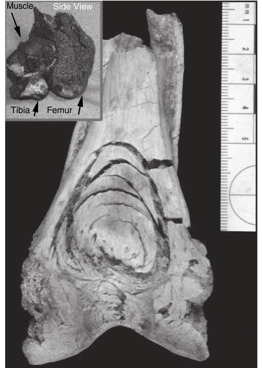 20 this figure is a posterior view of a distal femur. here
