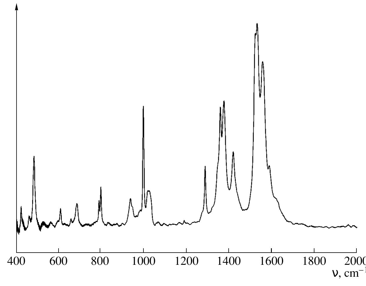 Figure 2 - from Synthesis and Structure of Oxovanadium(IV)