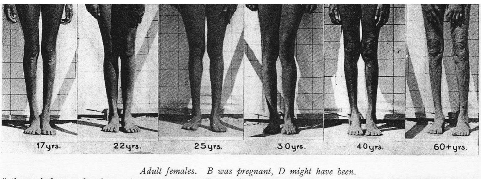 (PDF) The ‘Lubra’ Type in Australian Imaginings of Aboriginal Women ...