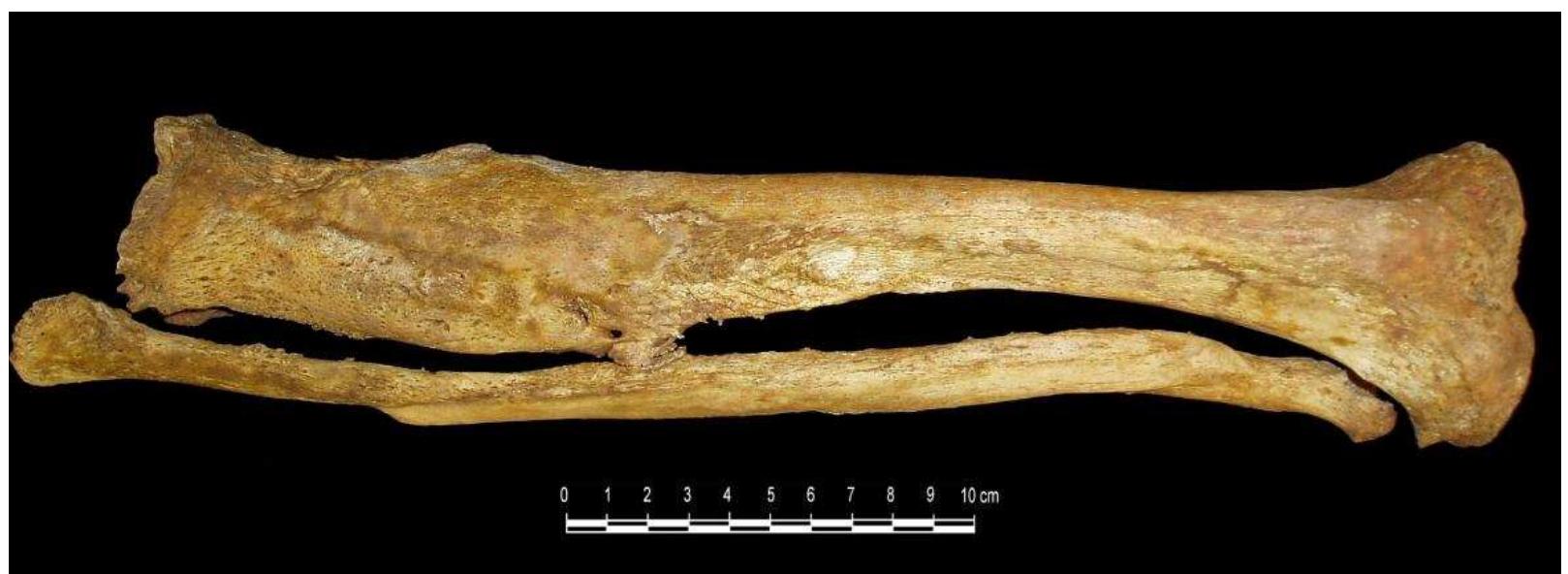 -7 left disarticulated tibia and fibula, anterior view. a