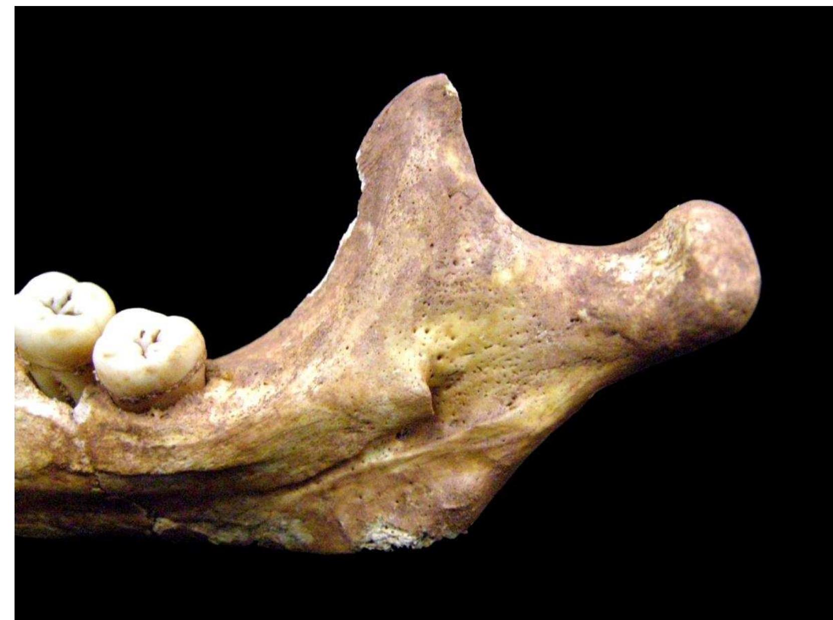 -31 porosity on the medial side of the ramus, superior to