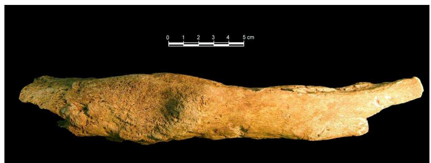 -11 left disarticulated amputated tibia, with a large cavity