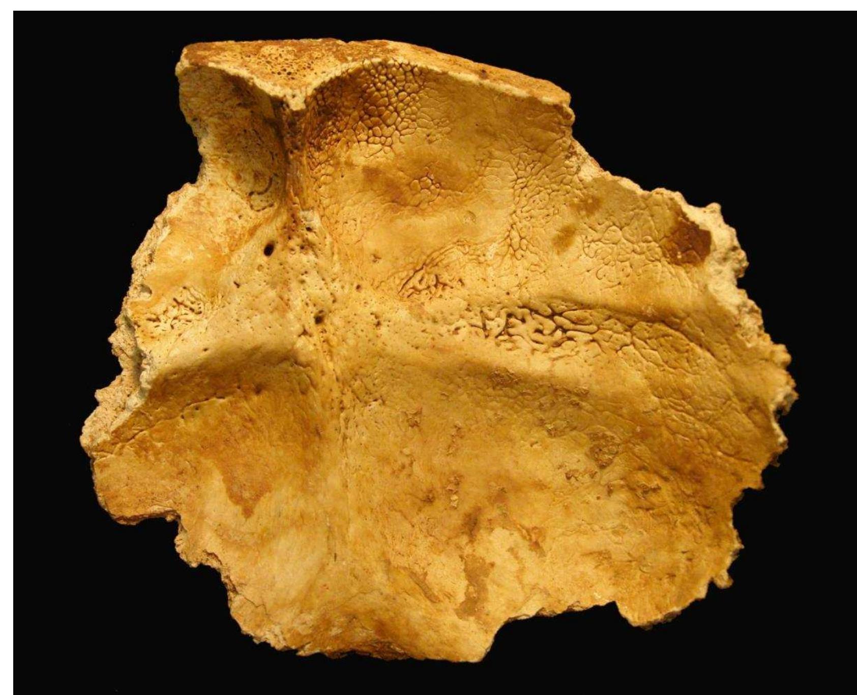 -1 c20, fiber bone formation on the transverse sagittal
