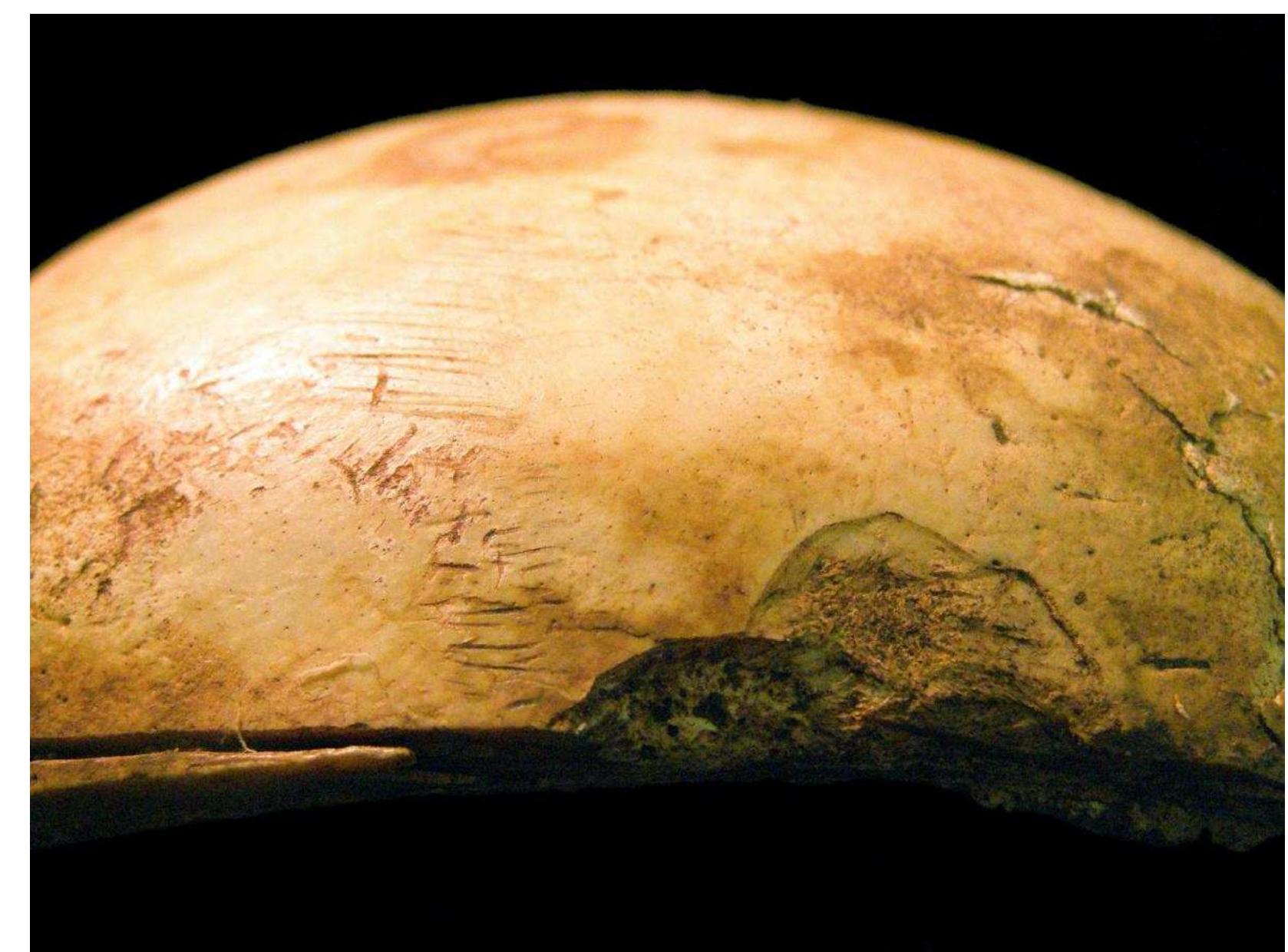 -5 c61, frontal bone with a leverage point on the left side.