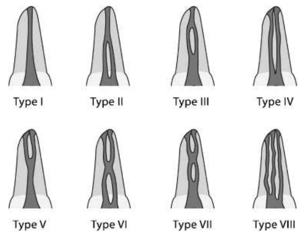 Diagrammatic representation of vertucci’s canal