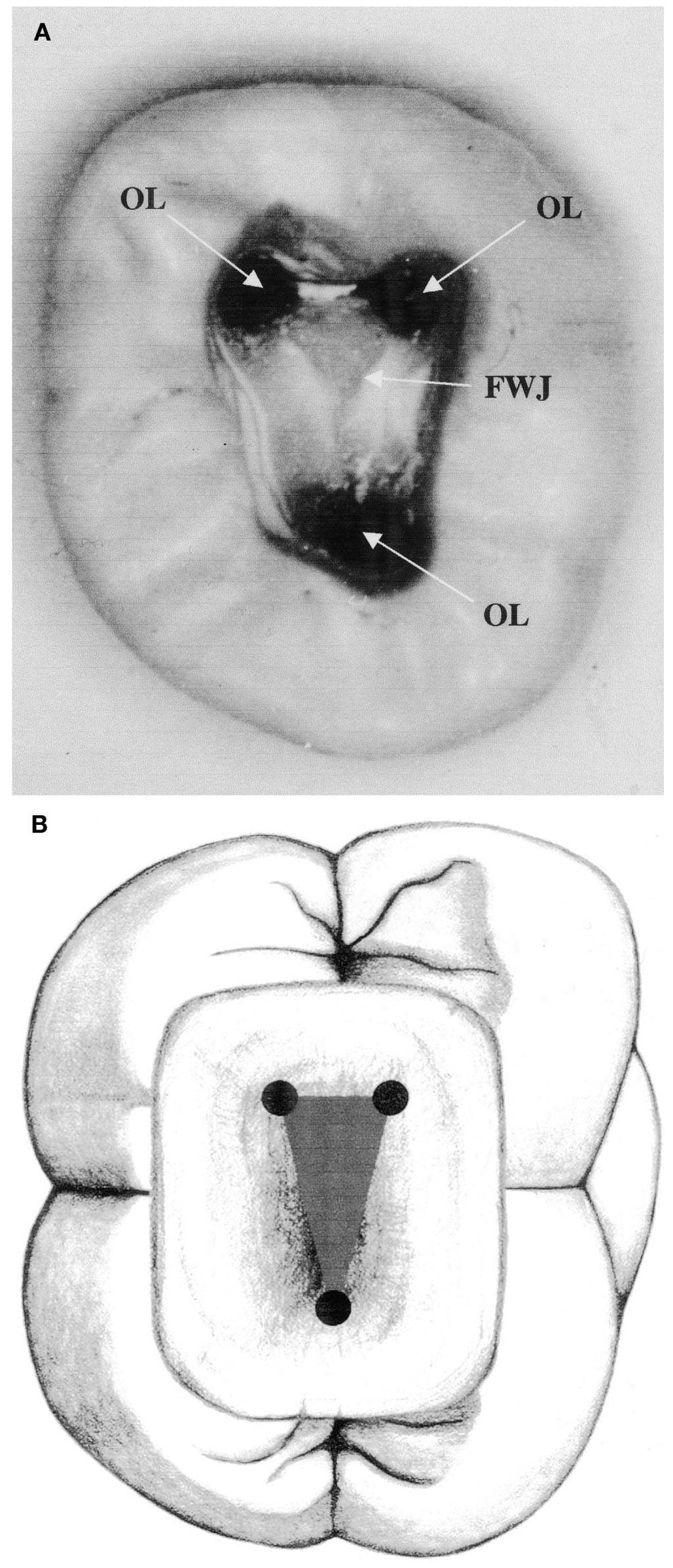 (PDF) 2004 Krasner - Anatomy of the Pulp-Chamber Floor