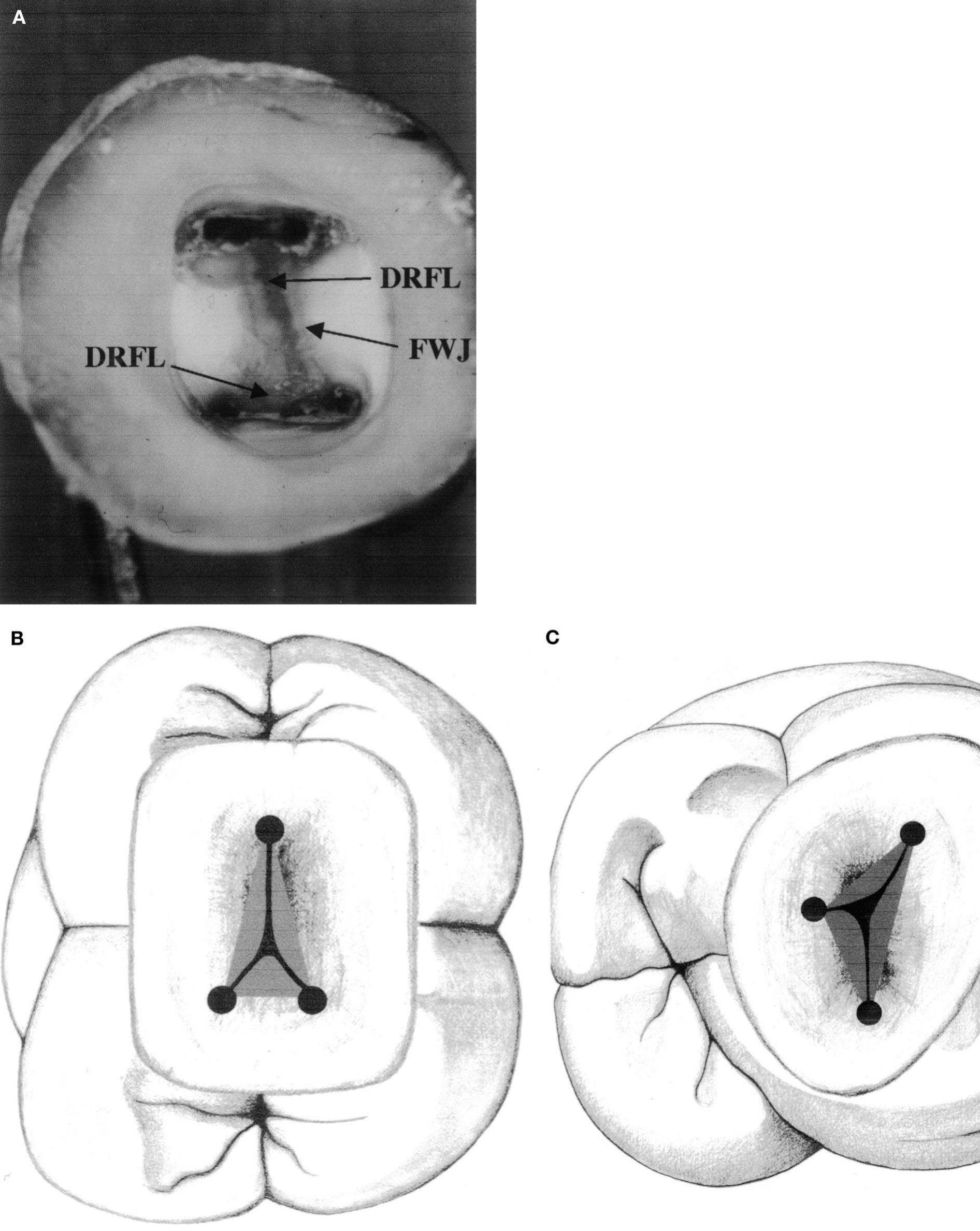 (a) cut specimen showing the developmental root fusion lines