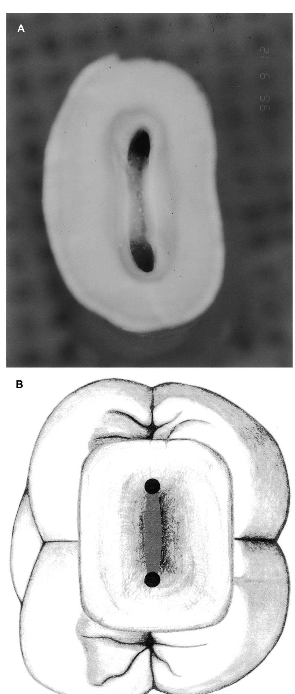 Fia 19. (a) cut specimen of a mandibular molar that, using