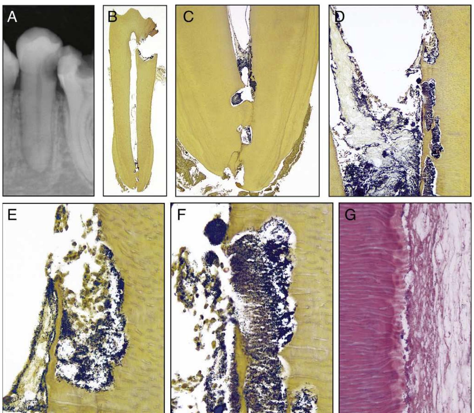 Light microscopy images of a case with early internal (root