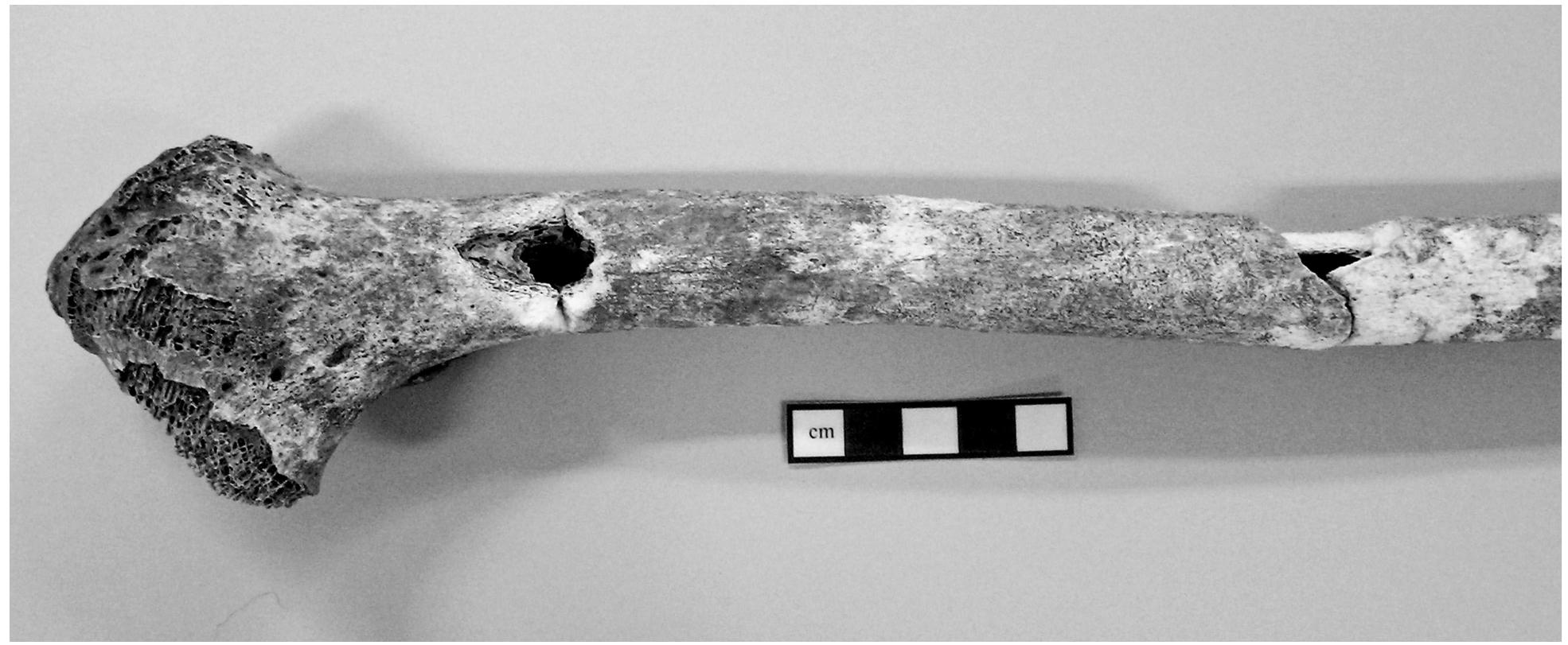 Skeleton 96. anterolateral bending of the proximal third of