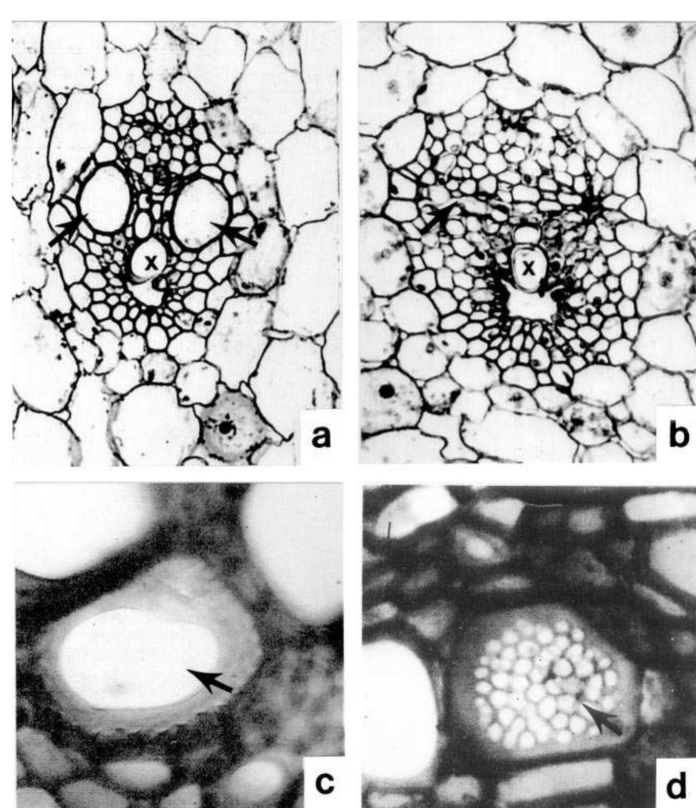 Figure 3 - VASCULAR TISSUE DIFFERENTIATION AND PATTERN