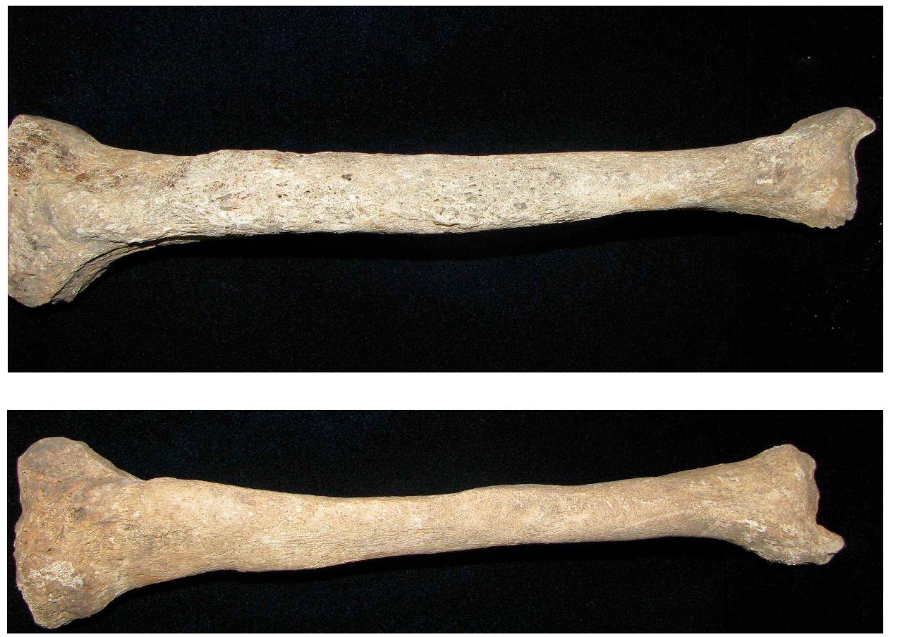 Ray examination is available fig. 19 lesions in the tibia.