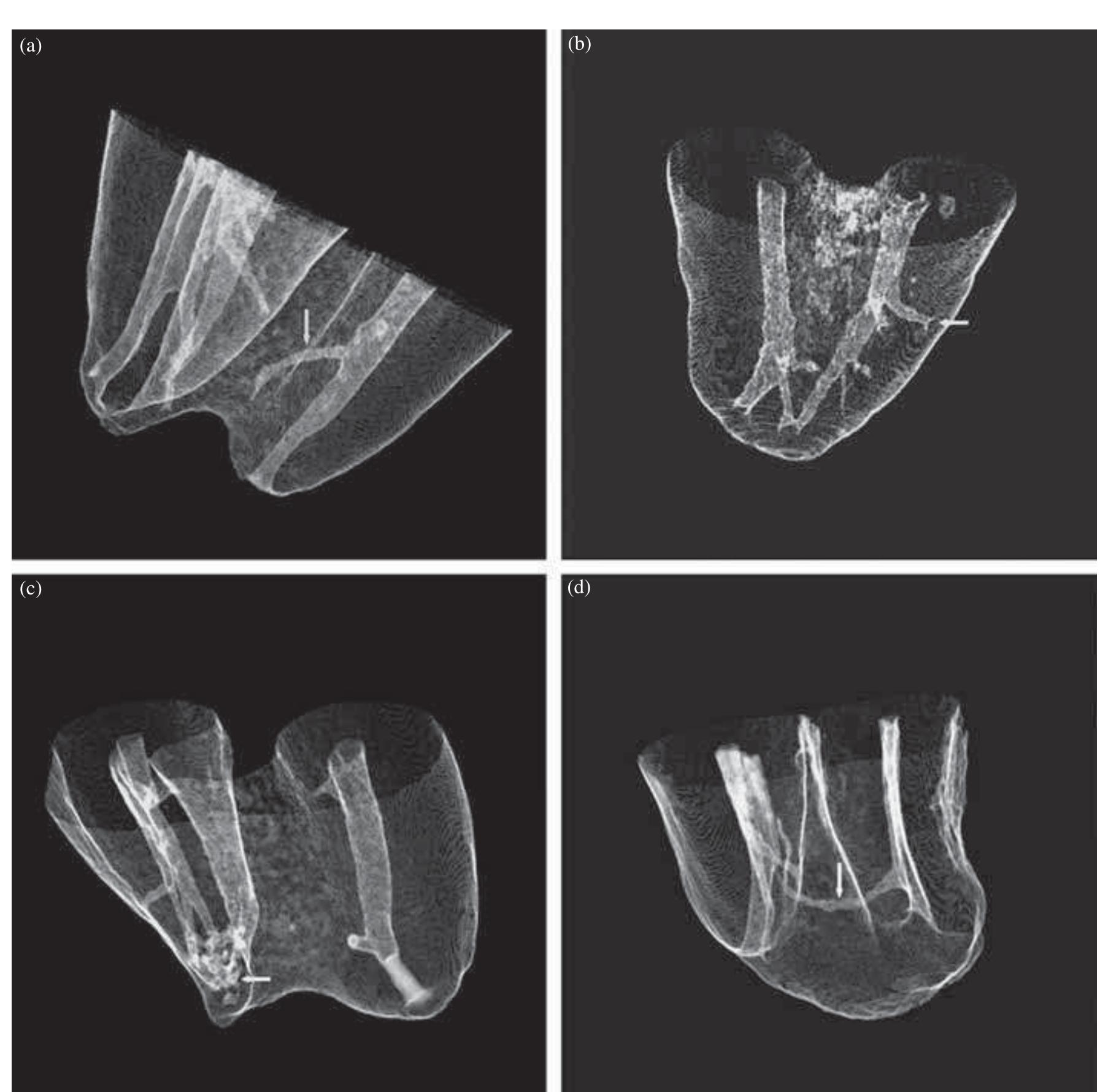 Example (arrow) of various anatomical features revealed by