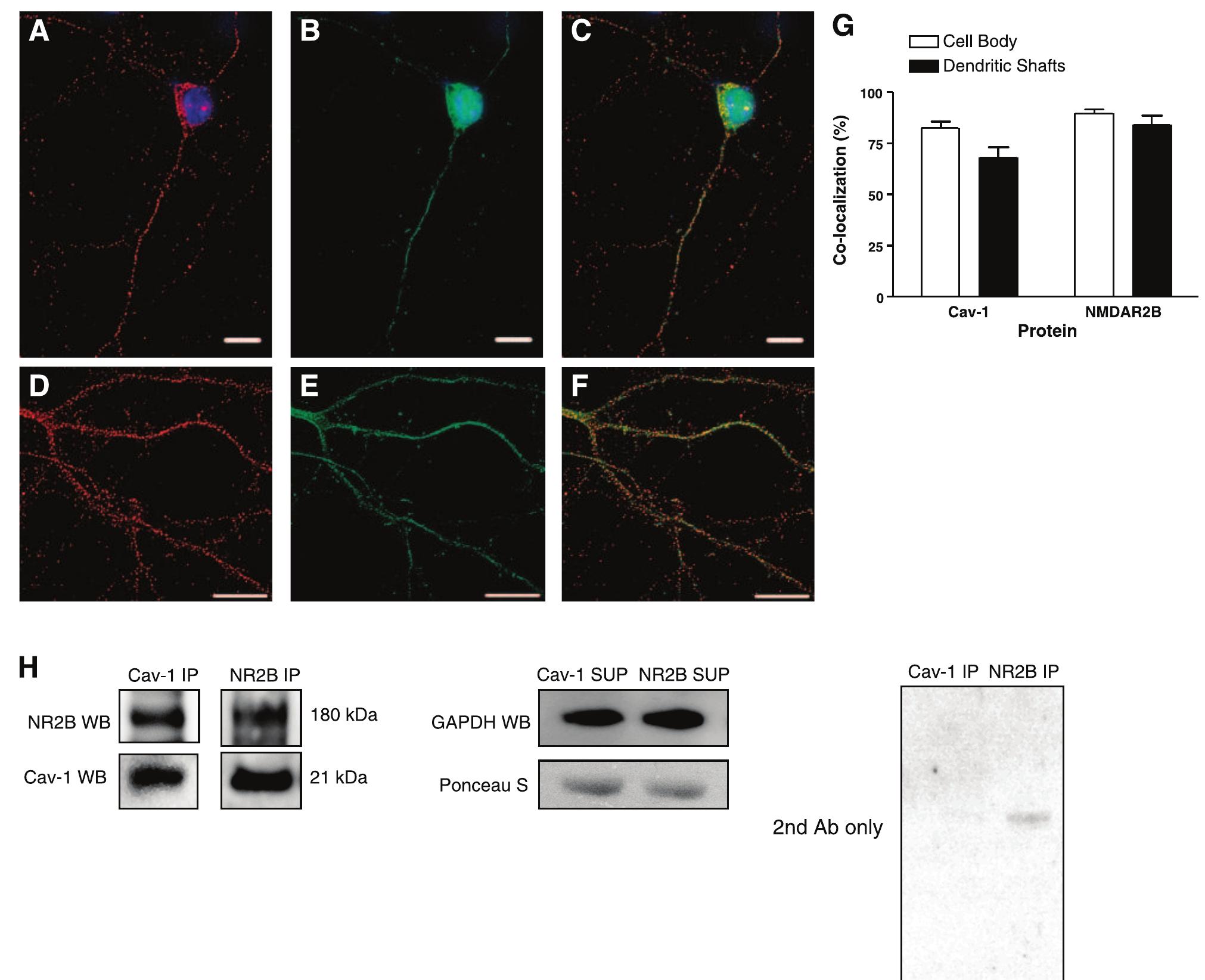 Immunofluorescence and deconvolution microscopy demonstrate