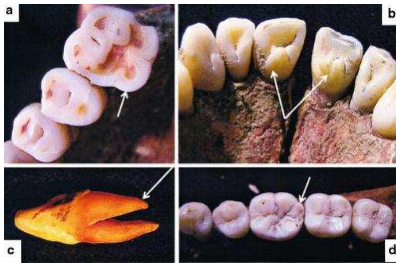Examples of minor variants of human tooth crowns and roots.