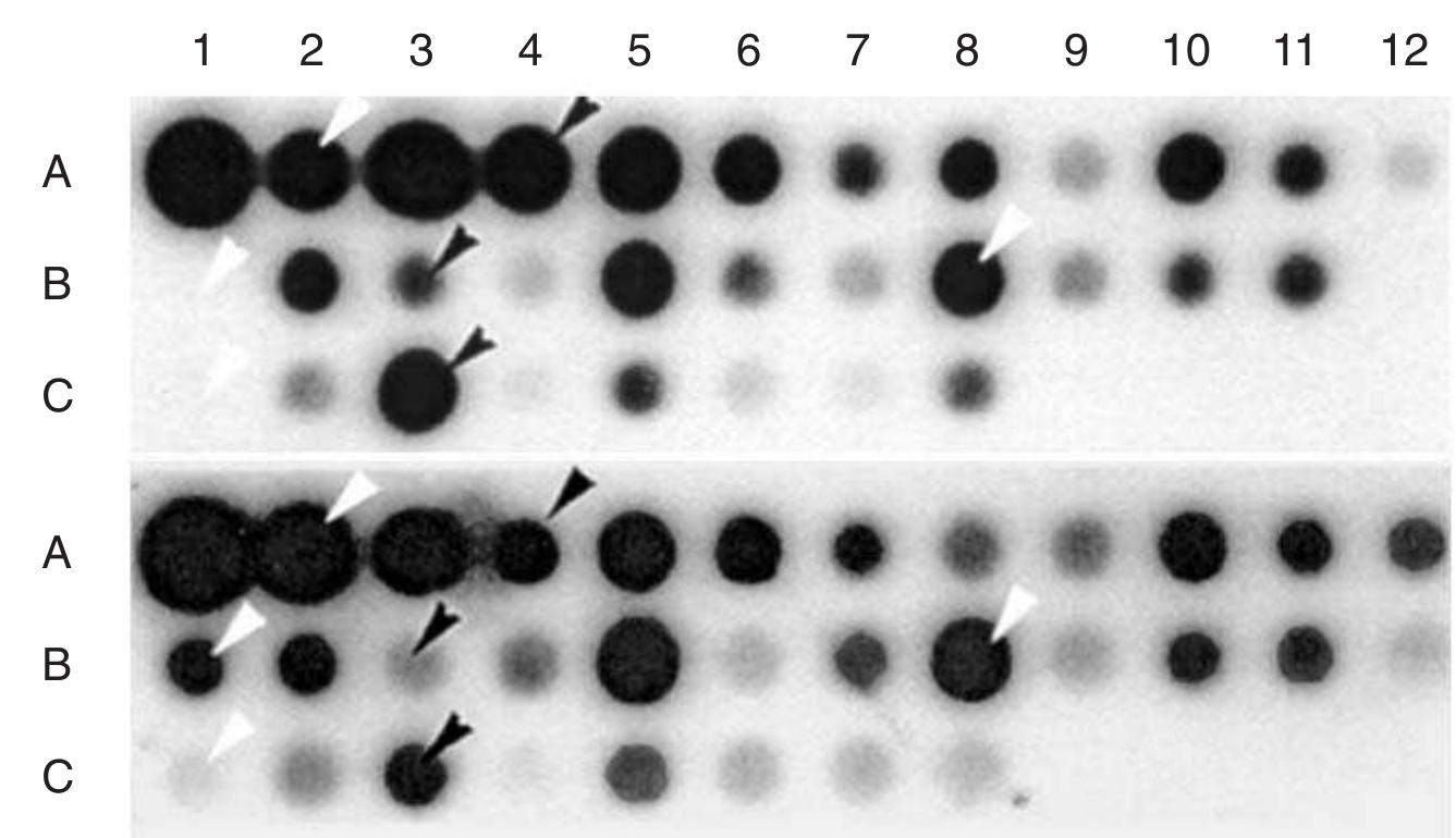 1. dot-blot analysis of gene expression in muscle tissues at