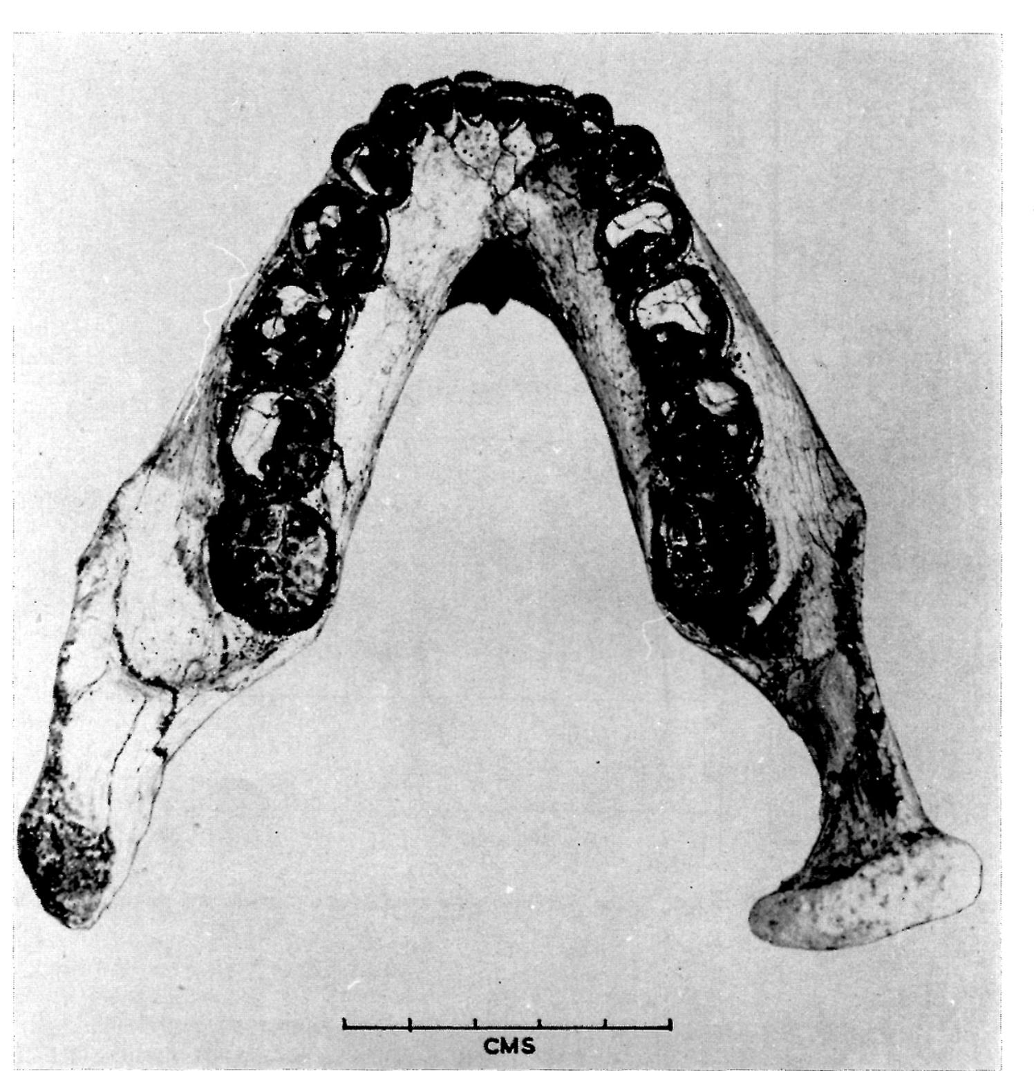 Fic. 3. — australopithecus boisei from peninj presents a
