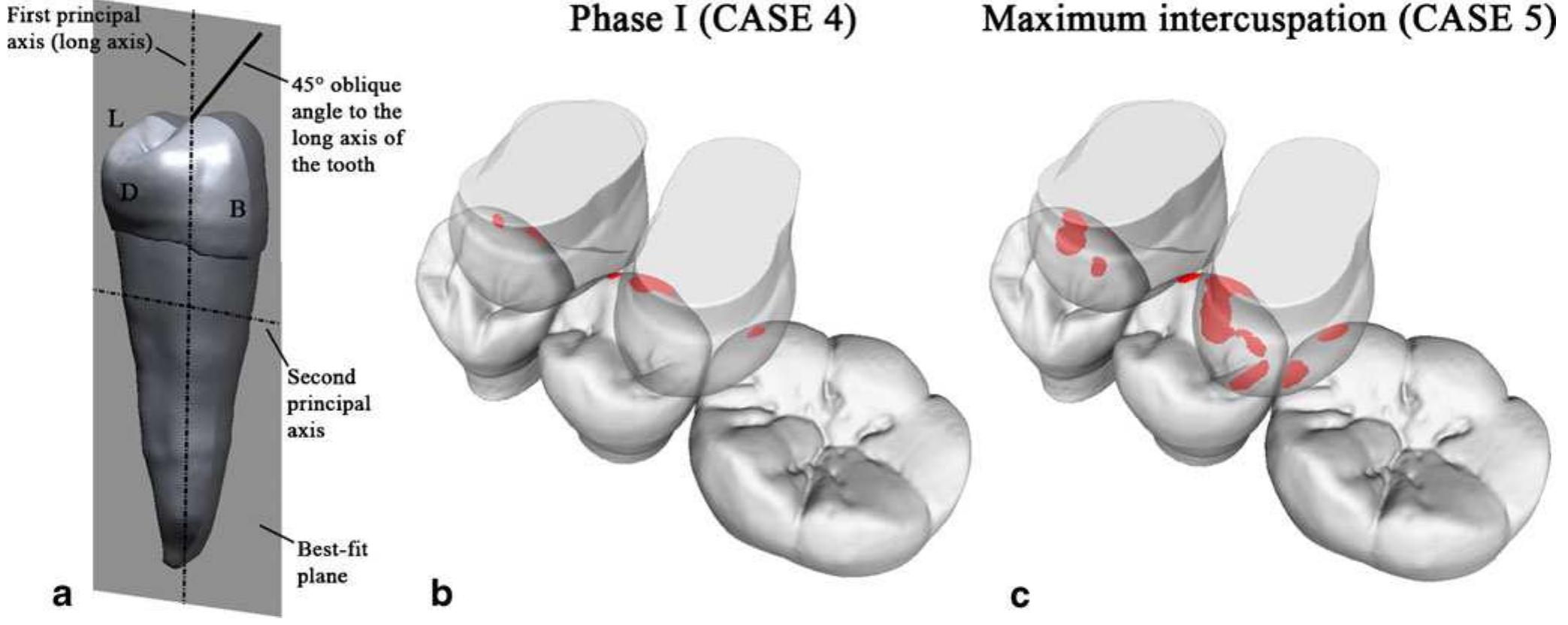 D = distal; l = lingual. b, ¢ collision detection for